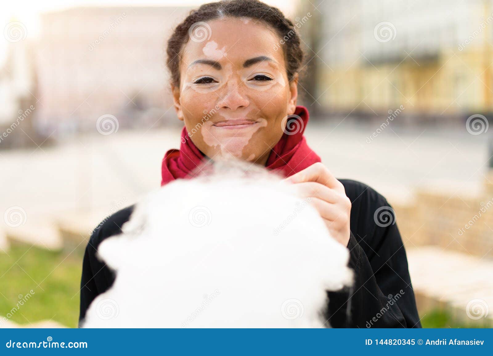 A Beautiful Young Girl Of African Ethnicity With Vitiligo Isolated