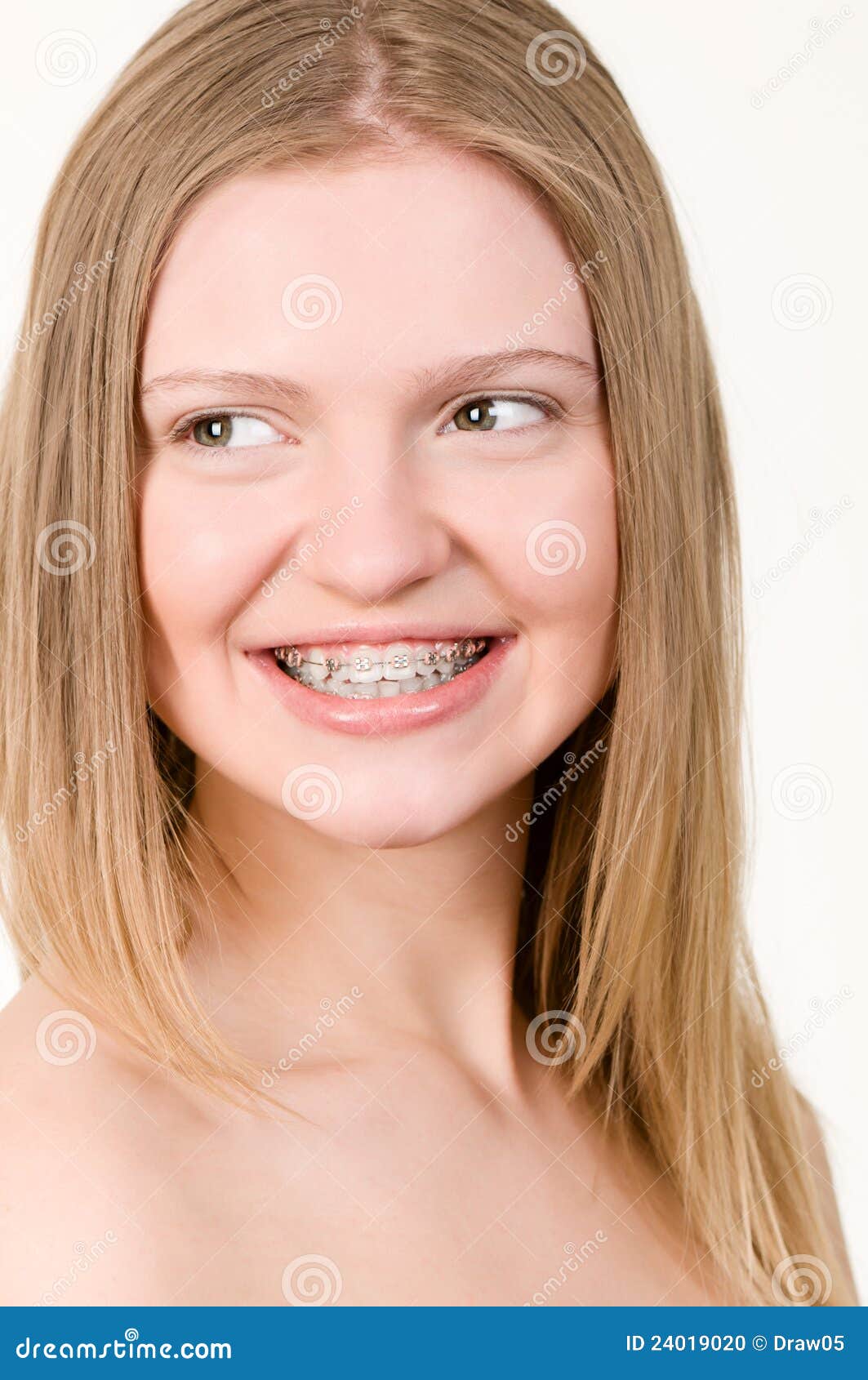 Beautiful Young Girl with Brackets on Teeth Stock Photo - Image of ...