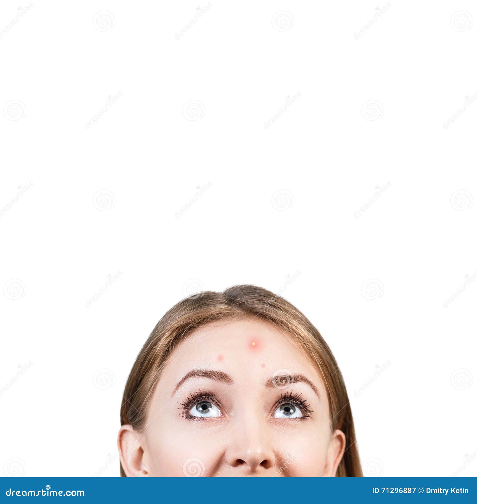 Beautiful Young Woman with Problem Skin Stock Image - Image of pimple ...