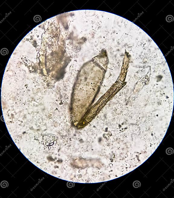 Bee leg under microscope stock image. Image of insect - 278877571