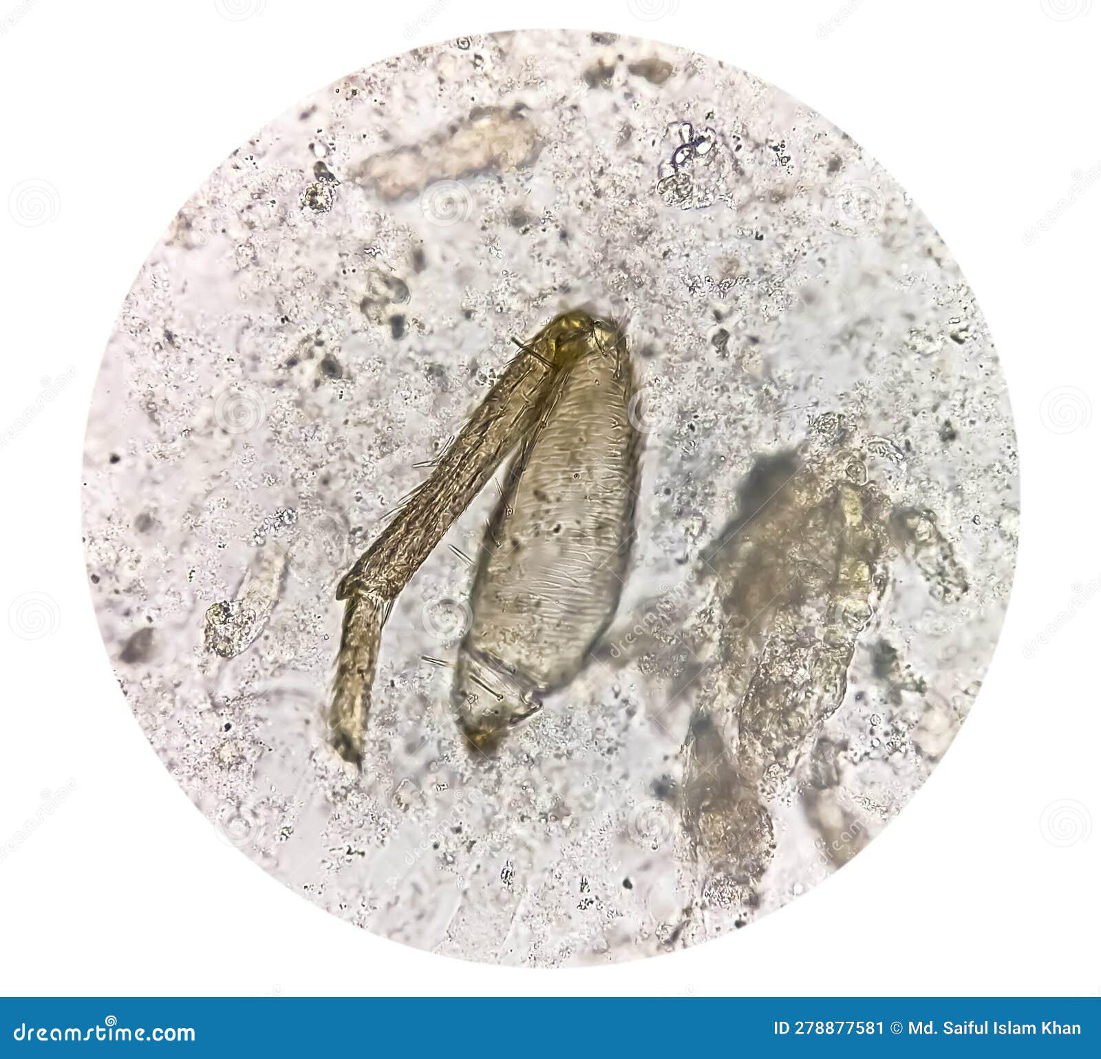 Bee leg under microscope stock image. Image of anatomy - 278877581