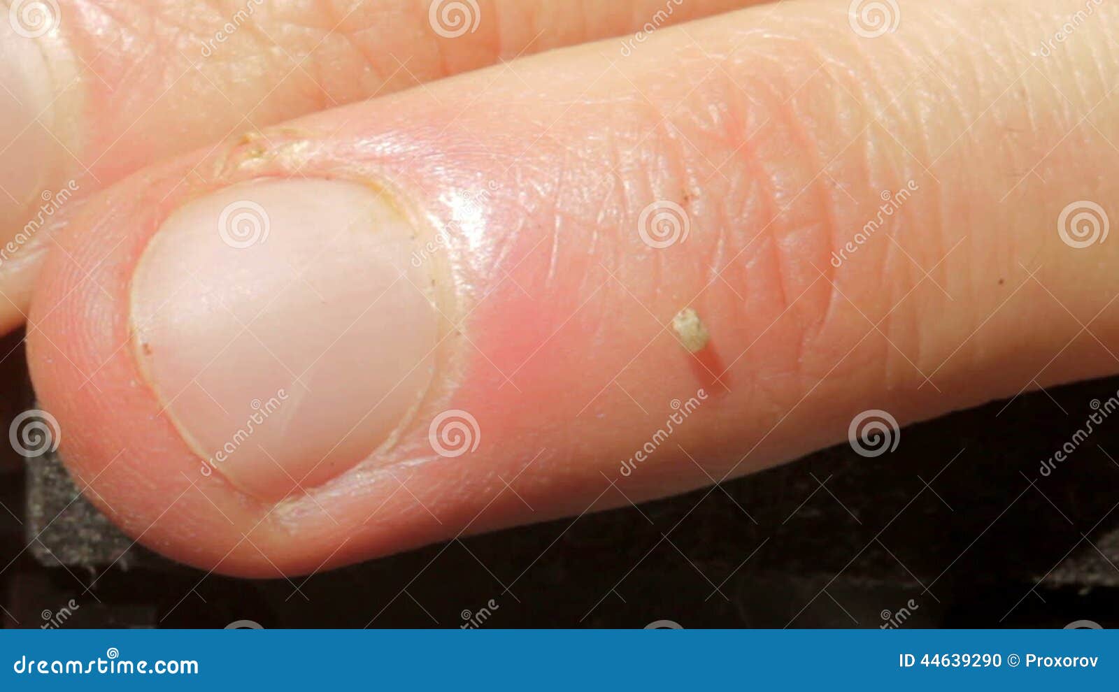 Sting Stock Footage & Videos - 3,453 Stock Videos