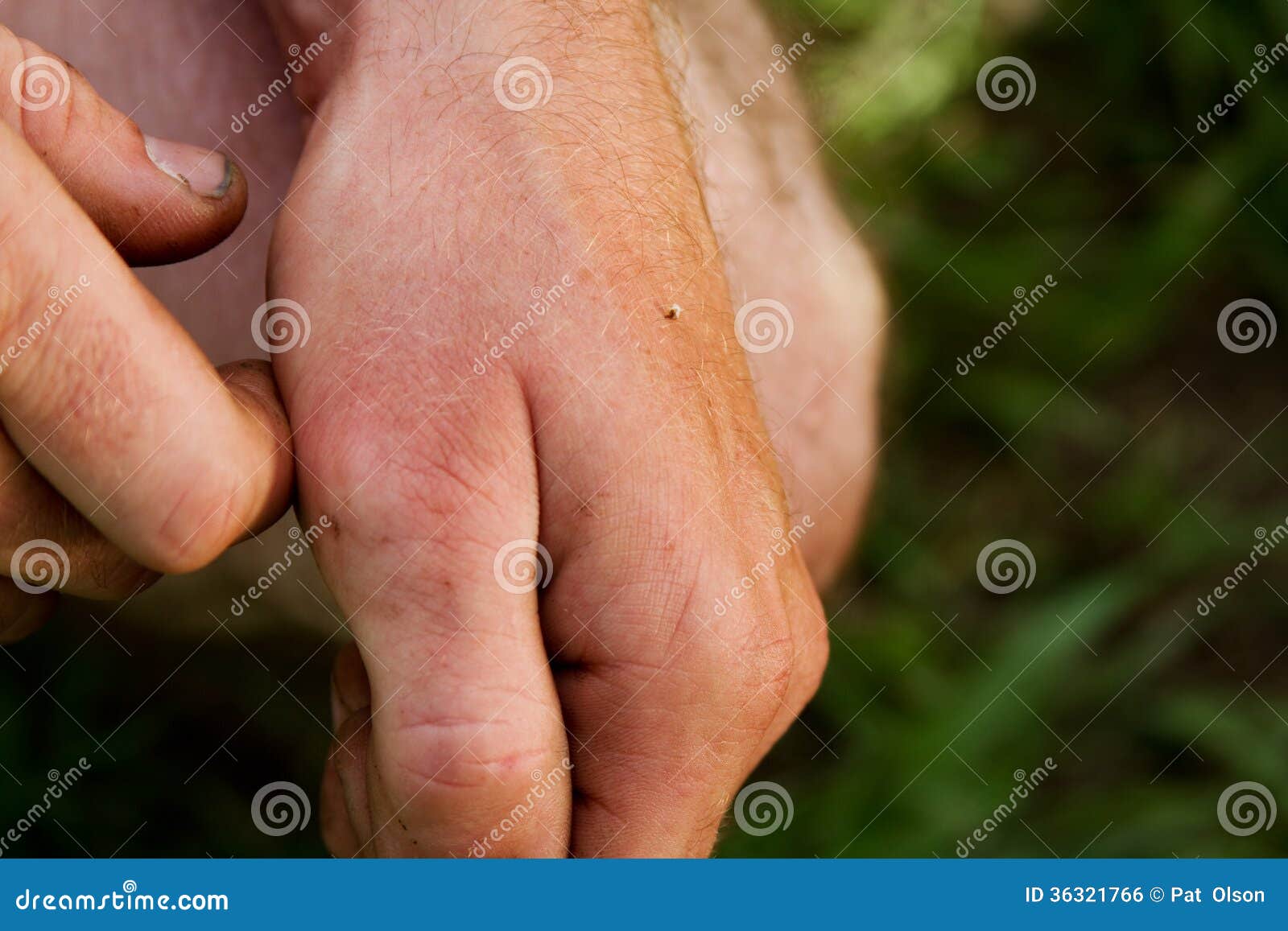 2,127 Hand Sting Photos - Free & Royalty-Free Stock Photos from Dreamstime