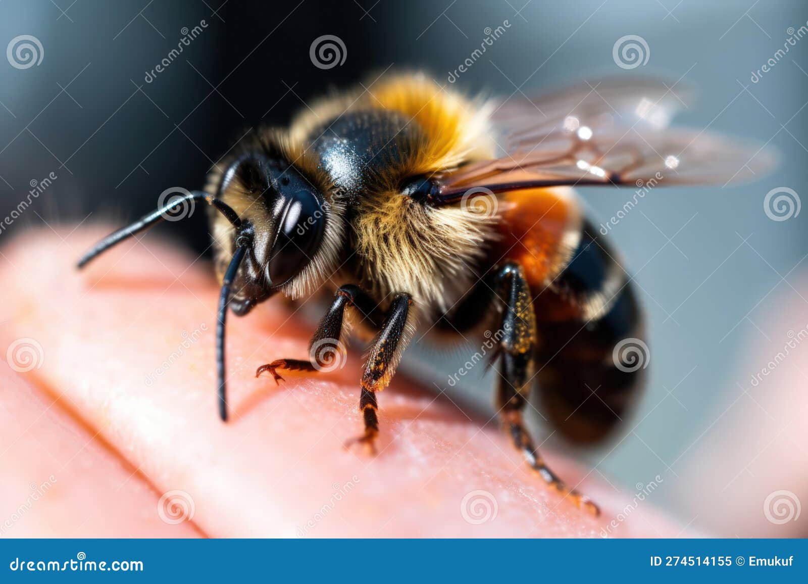 Bee Stung on the Finger Generative Ai Stock Illustration - Illustration ...