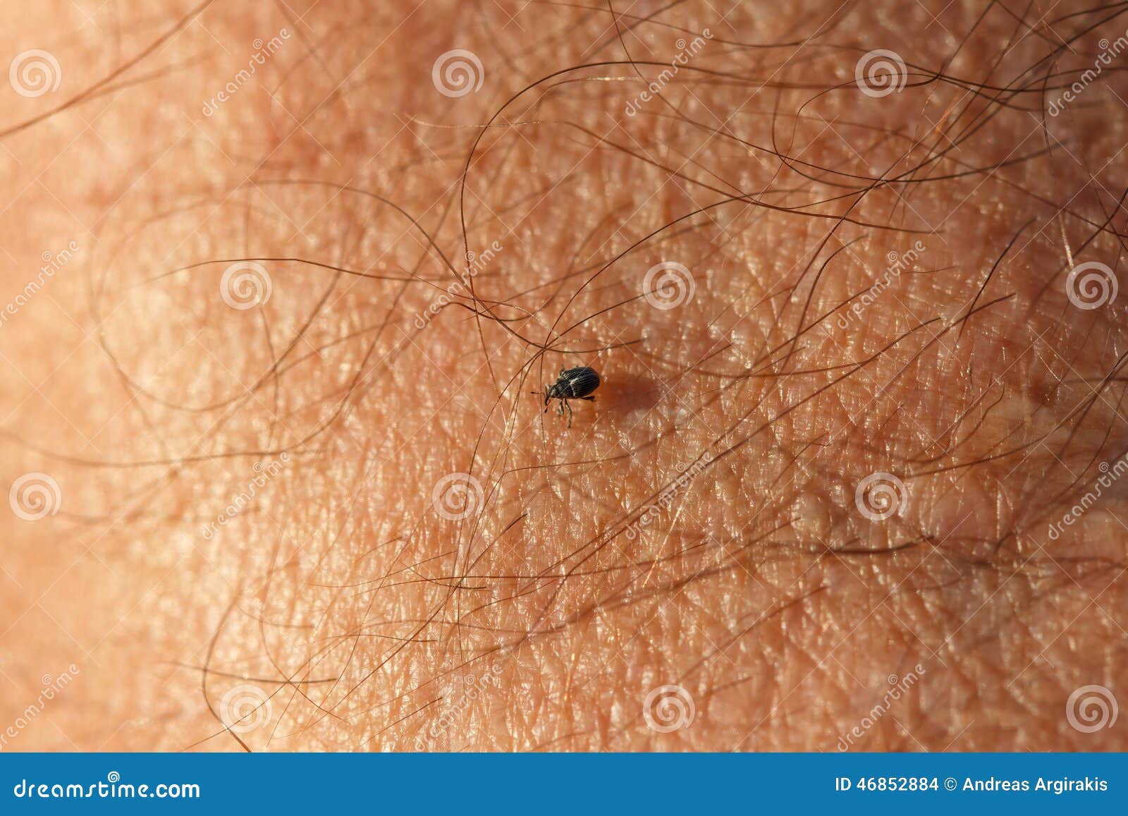 Beetle on human skin stock photo. Image of small, textured - 46852884