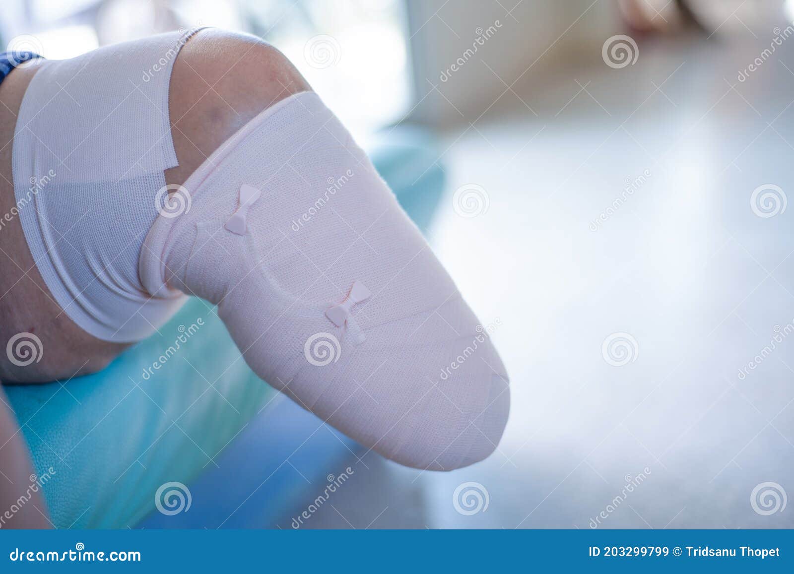 Below Knee Amputation Bandaging Stock Image - Image of elderly ...