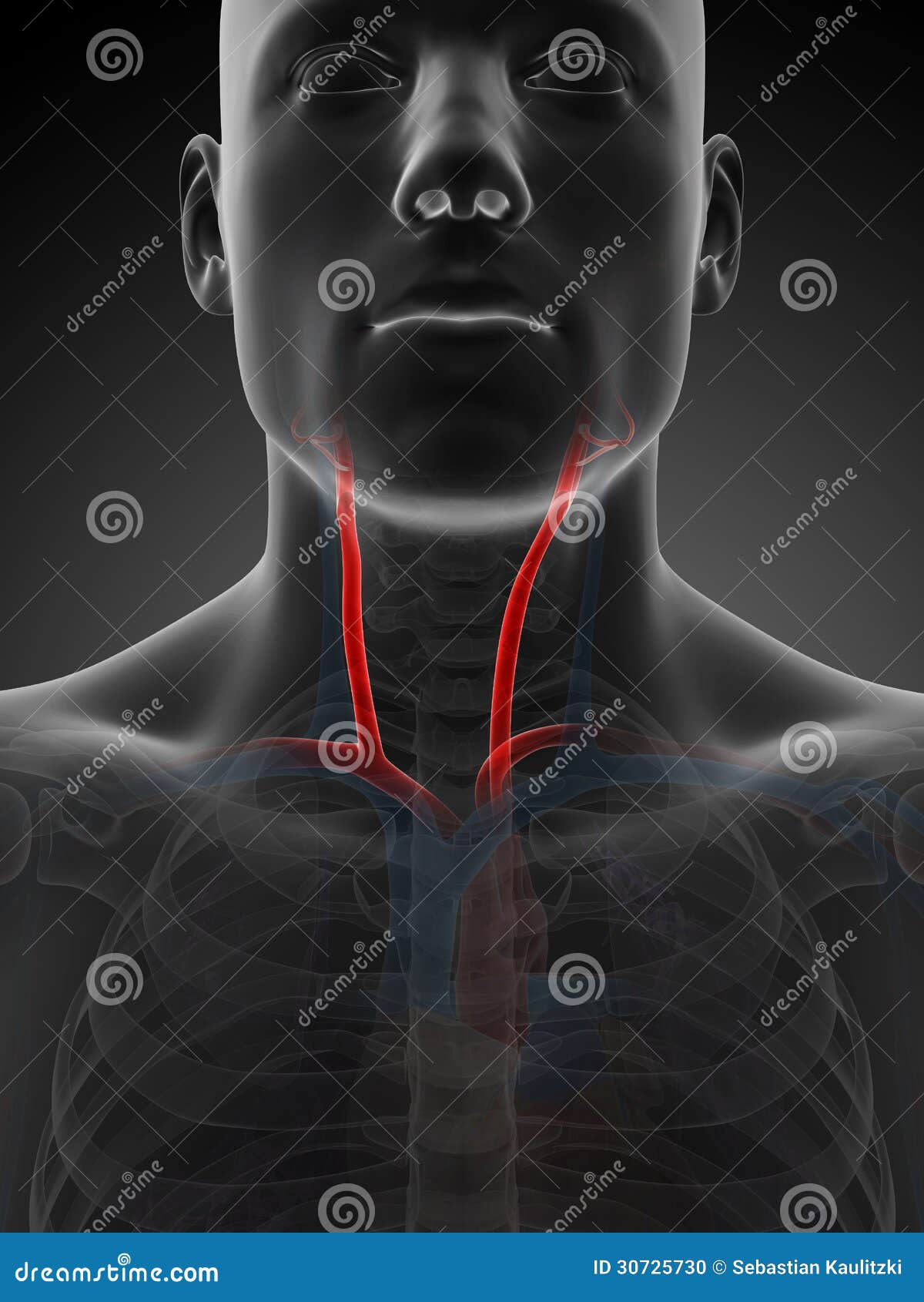 Benadrukte Slagader Van De Halsslagader Stock Illustratie ...