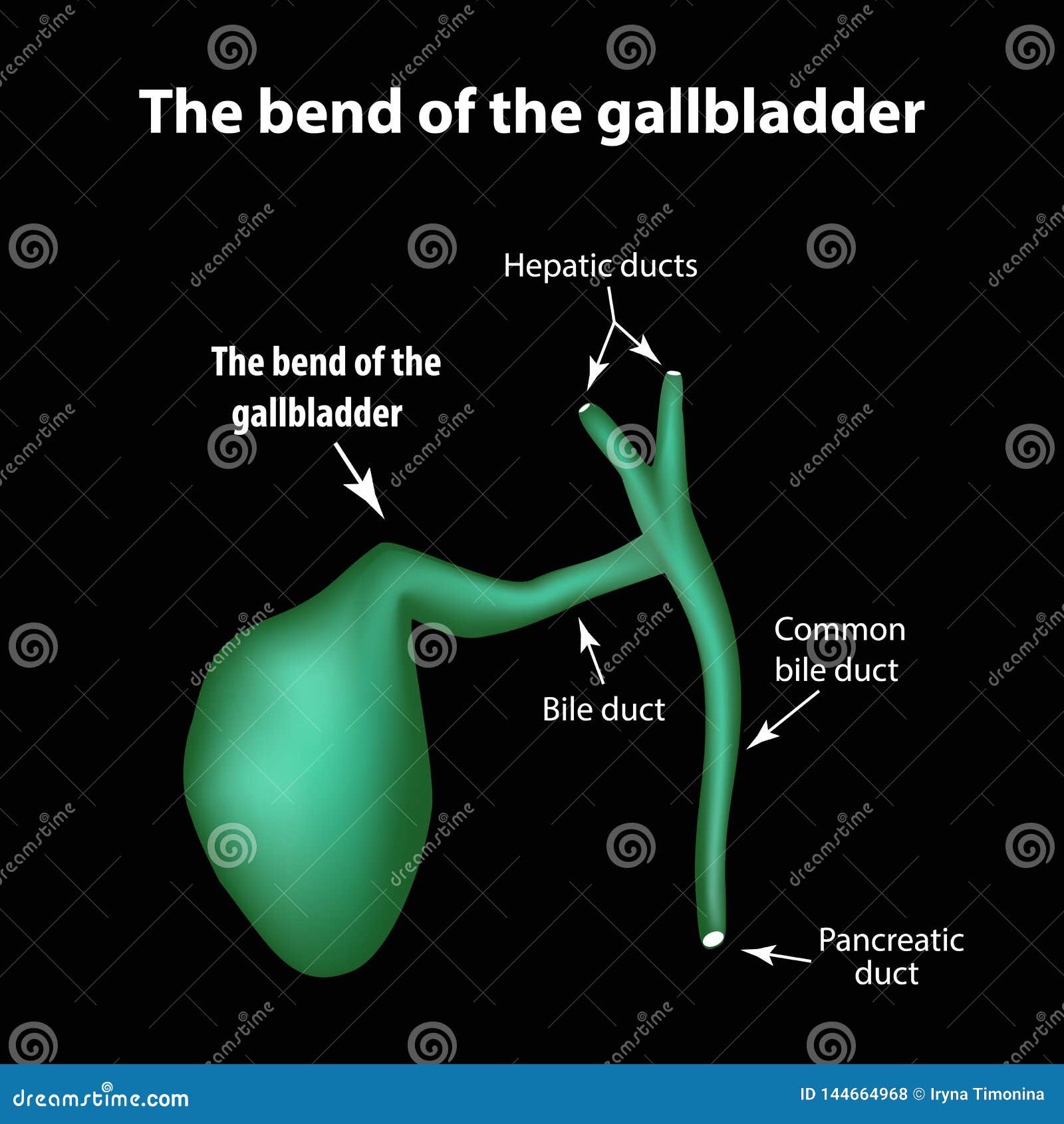 The Bend of the Gallbladder. Pathology of the Gallbladder ...
