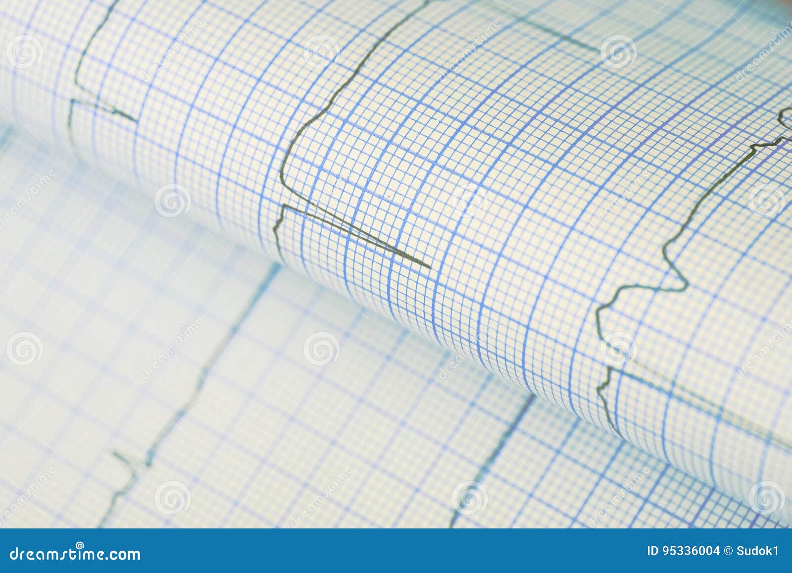 Bended ECG Chart As a Medical Background Stock Photo - Image of ...