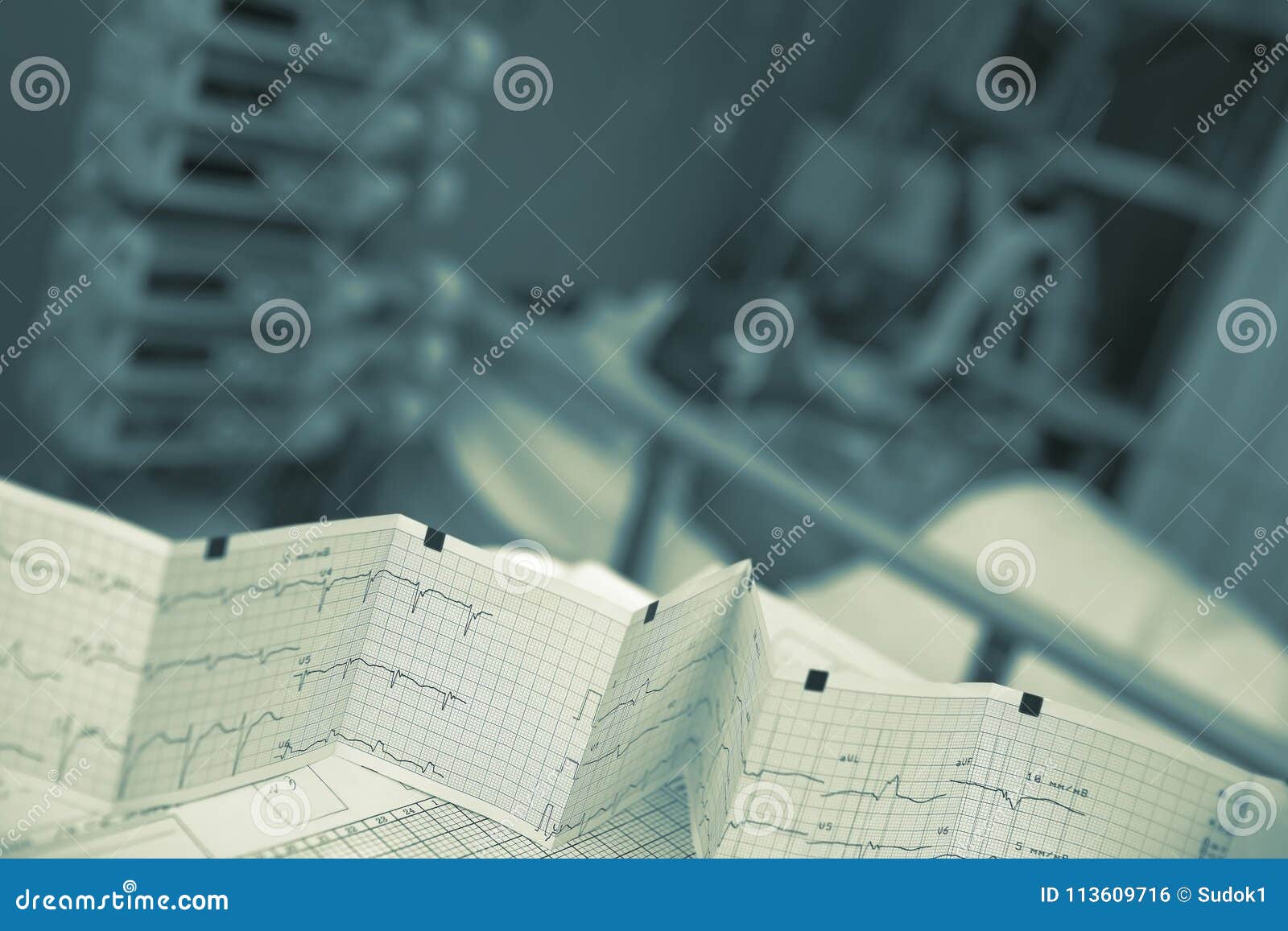 Bended ECG Record on the Nursing Table the Patient Bedside Stock Photo ...