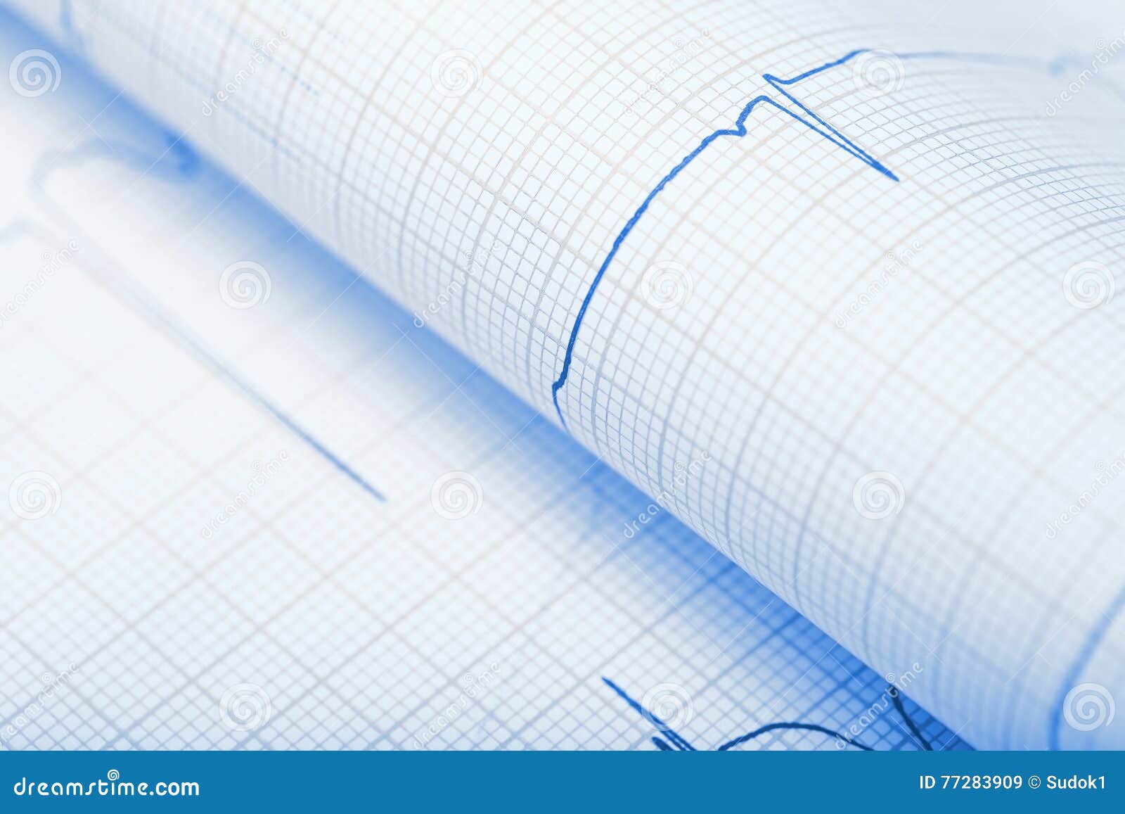 Bended Ecg Paper On The Background Of Hospital Room Royalty-Free Stock ...