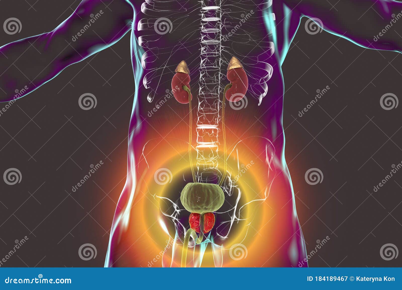 Benign Prostatic Hyperplasia Stock Illustration - Illustration of ...