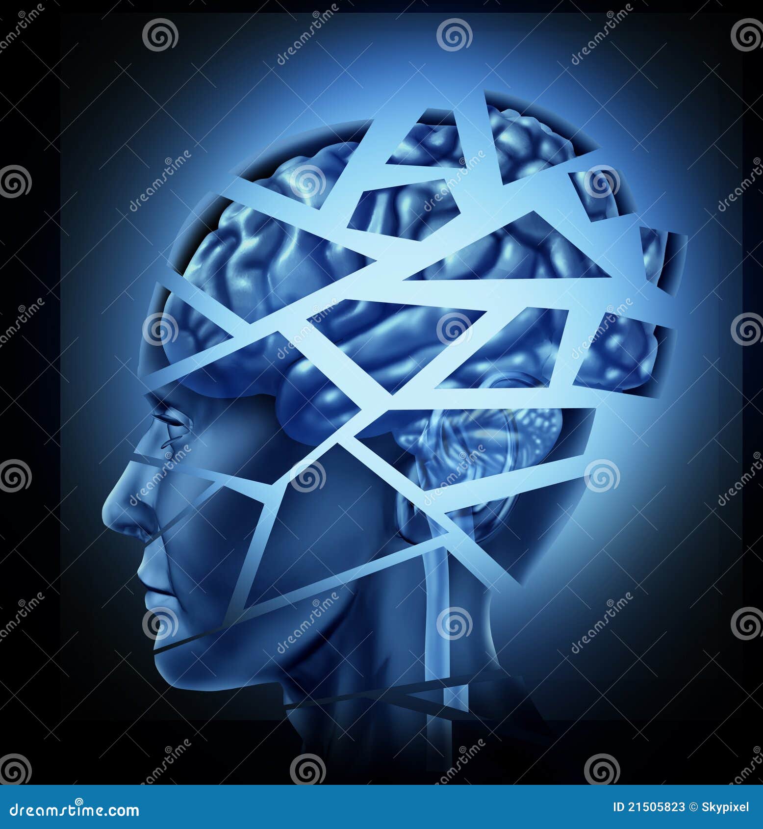 Beschadigde Menselijke Hersenen Stock Illustratie - Illustration of ...