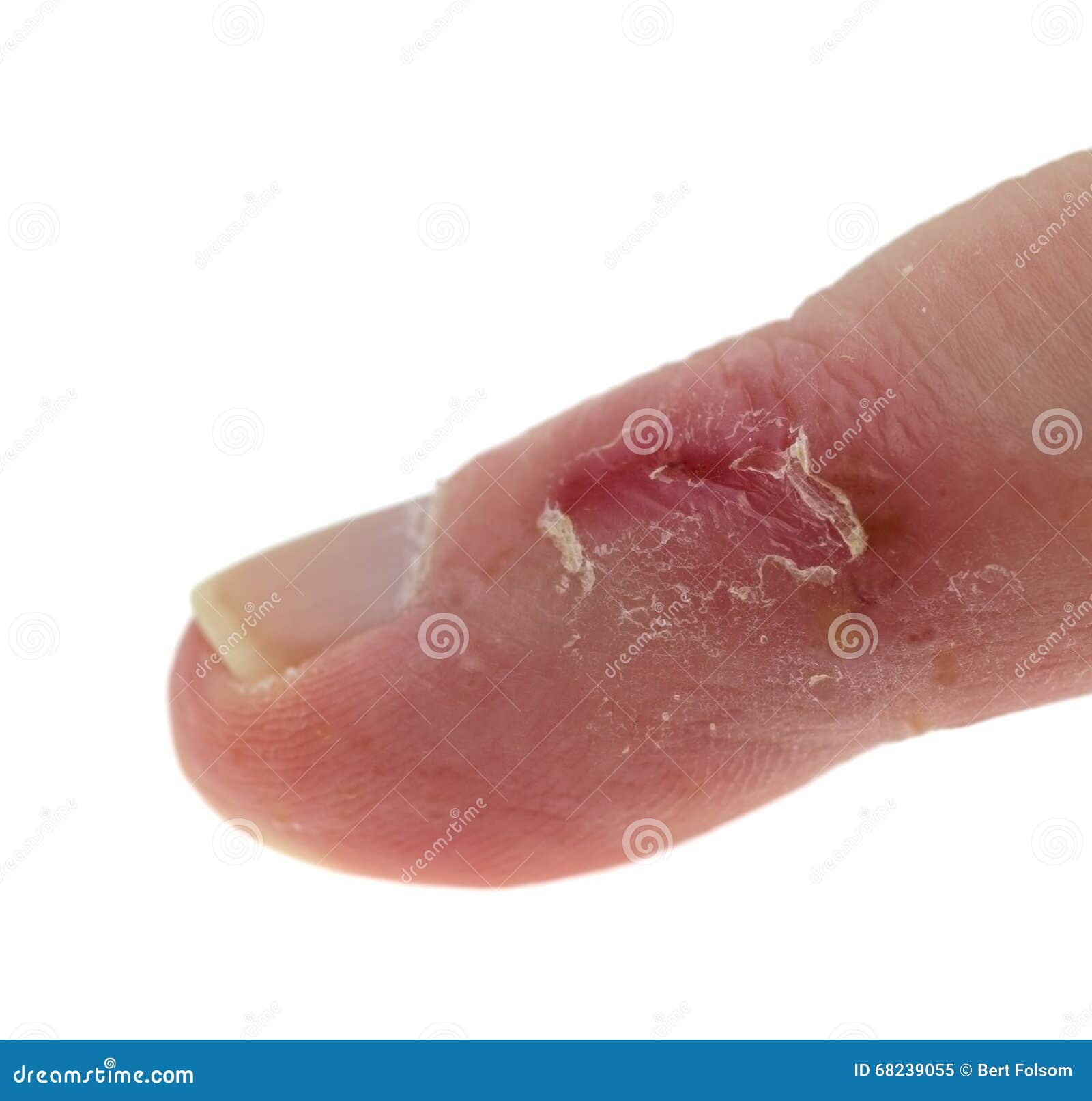Besmette Vinger Op Een Witte Achtergrond Stock Afbeelding - Image of ...