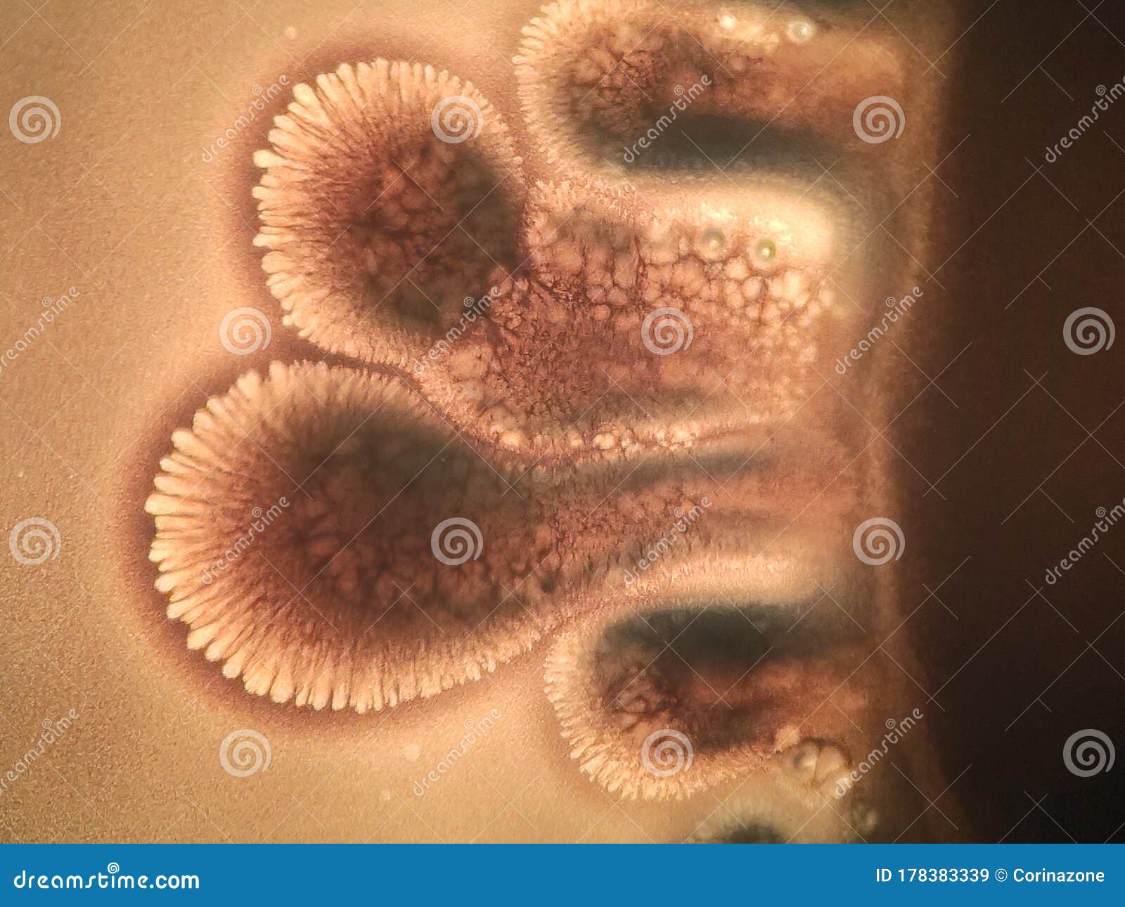 Beuatiful Fractal Pattern Bacterial Colonies Under the Microscope Stock ...