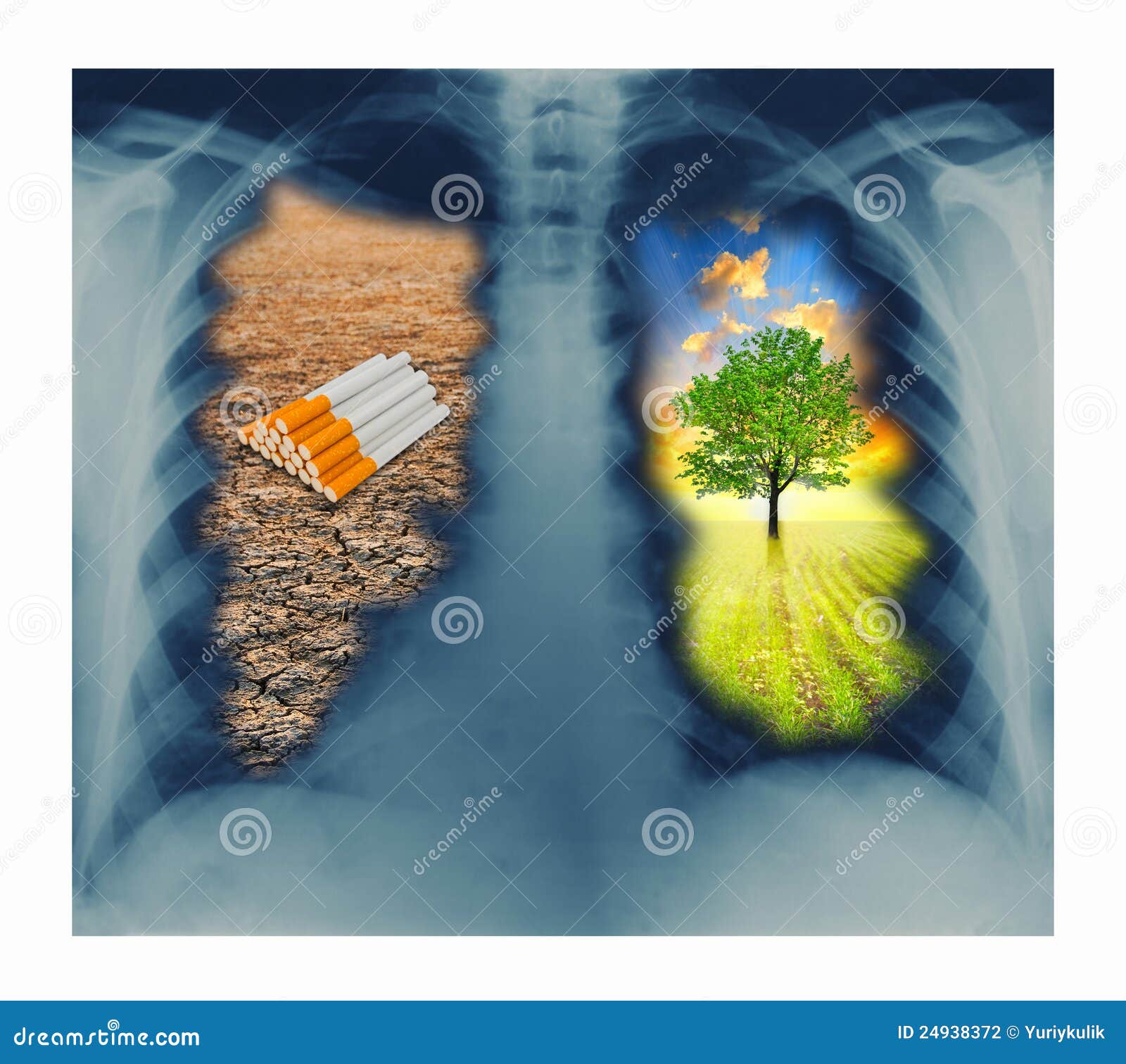 Beware no smoking stock photo. Image of cure, disease - 24938372