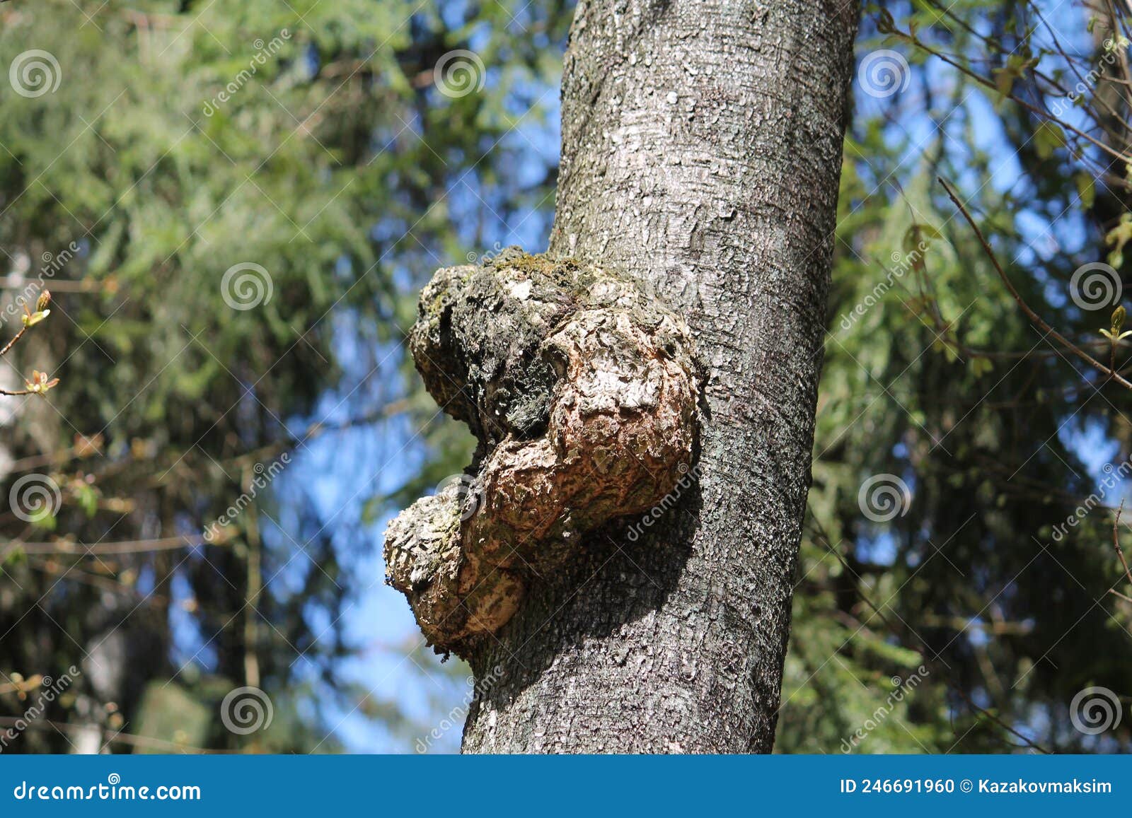 Big Burl on Birch Tree Trunk Stock Photo - Image of phytopathology ...
