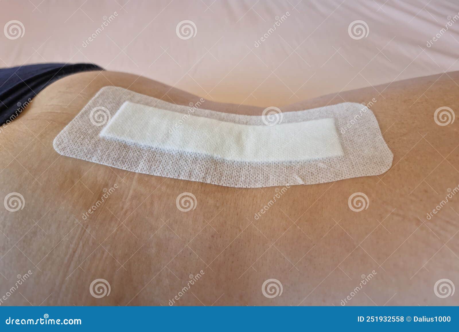 Big Plaster on Men`s Back after Spine Operation - Herniated Discs ...