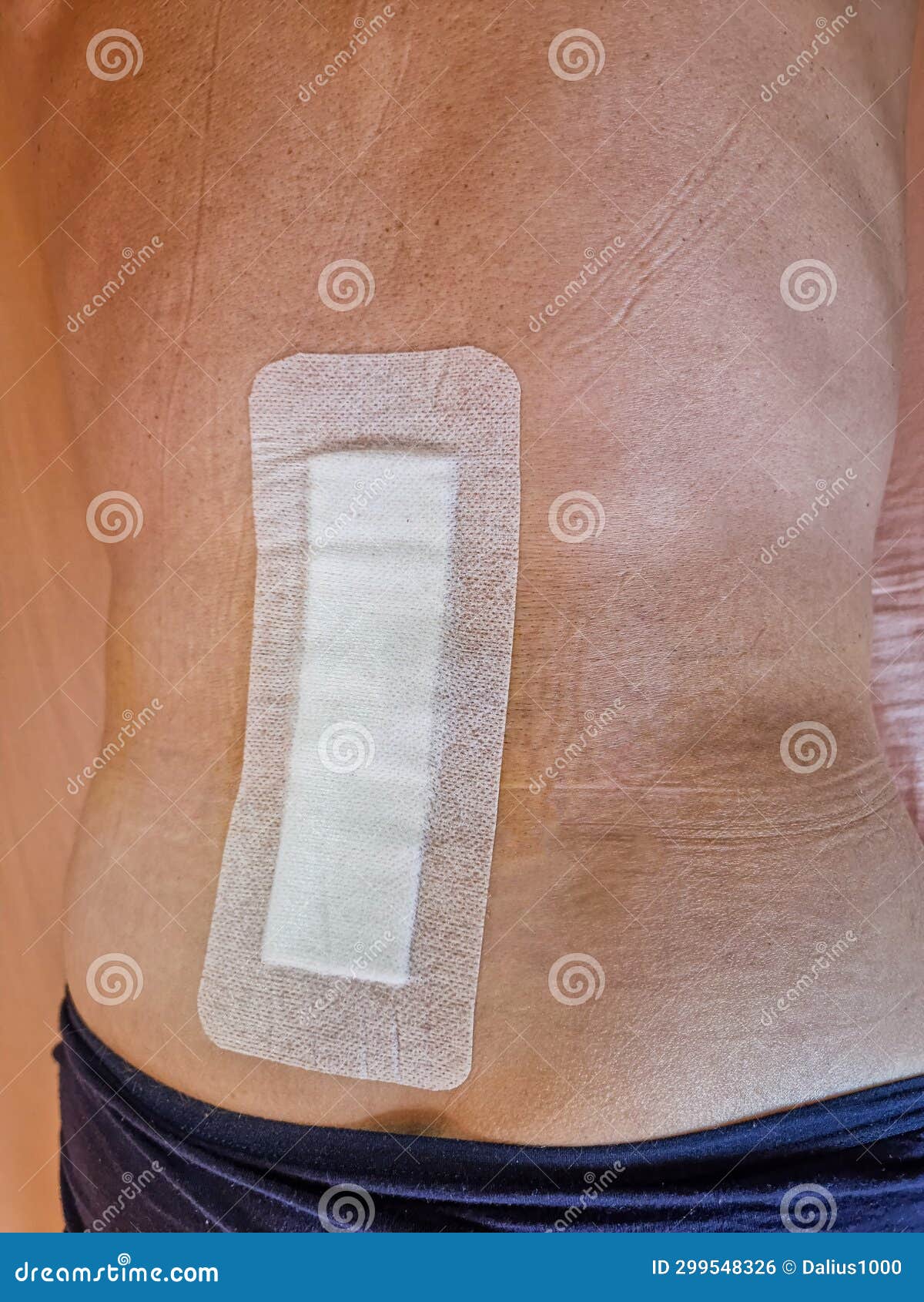 Big Plaster on Men S Back after Spine Operation - Herniated Discs ...