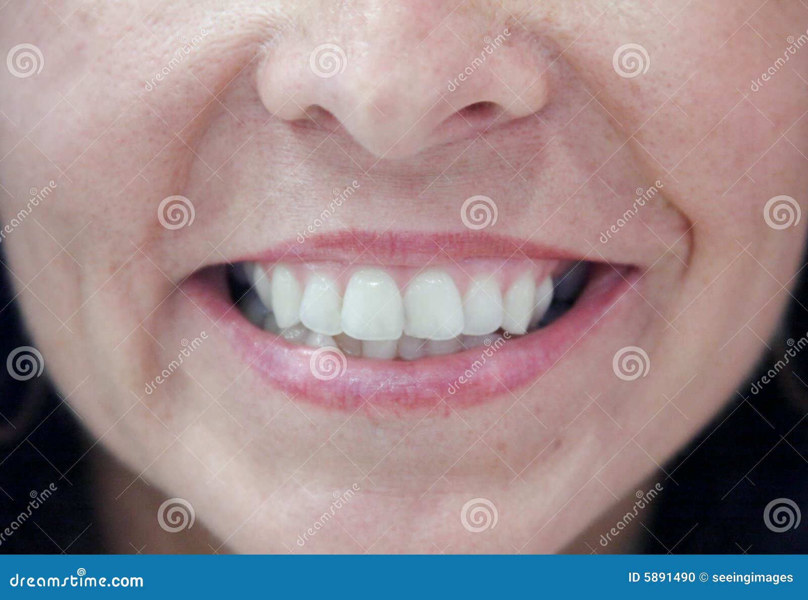 Big Smile Picture. Image: 5891490