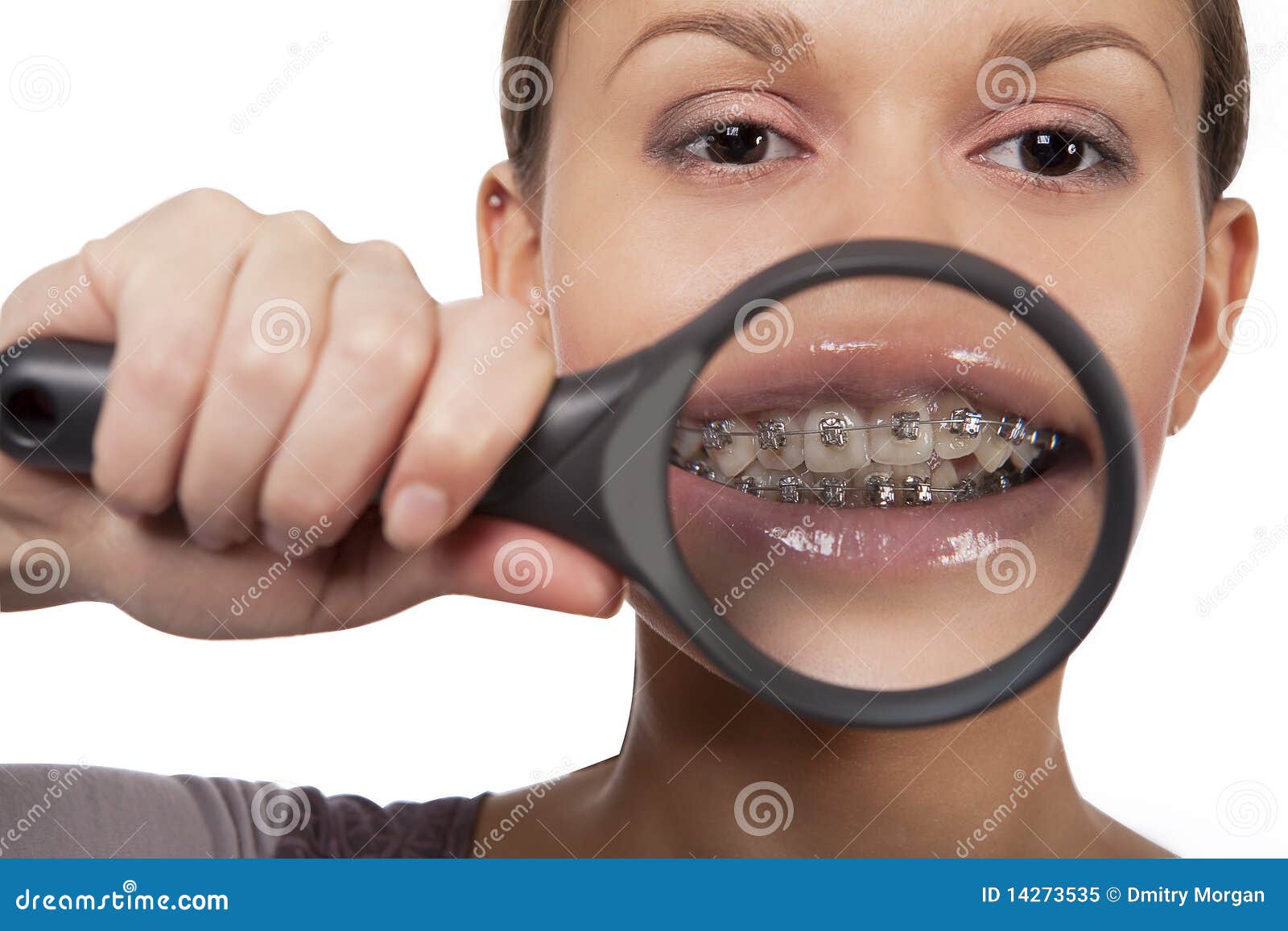 Big teeth stock image. Image of female, girl, dent, dental - 14273535