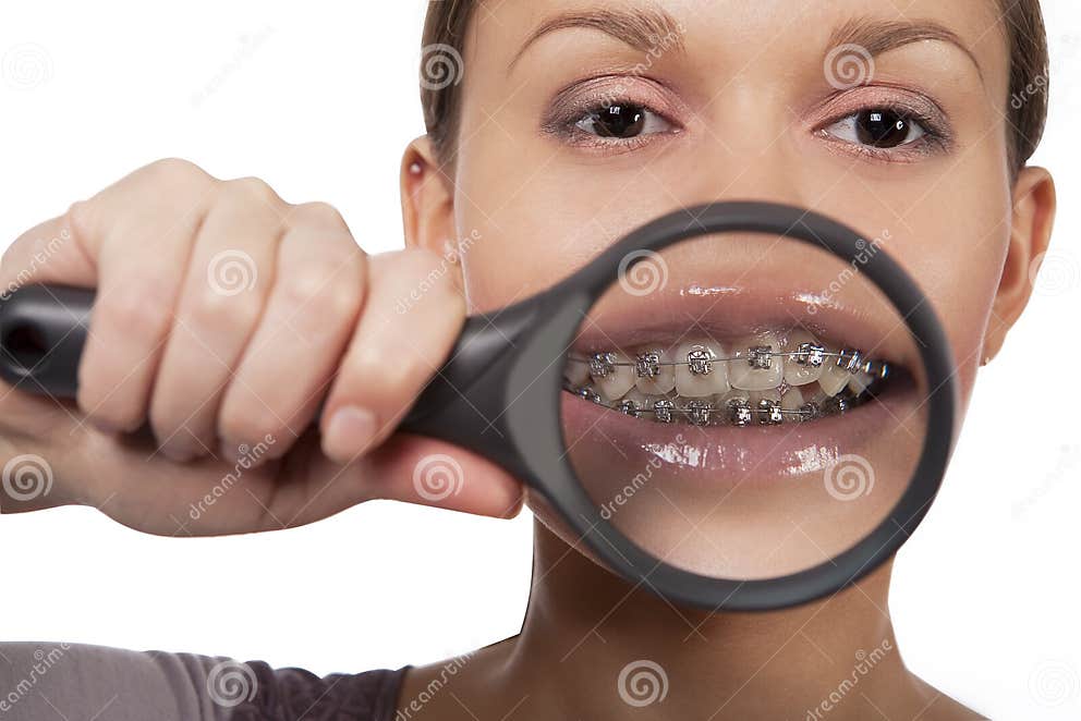 Big teeth stock image. Image of female, girl, dent, dental - 14273535
