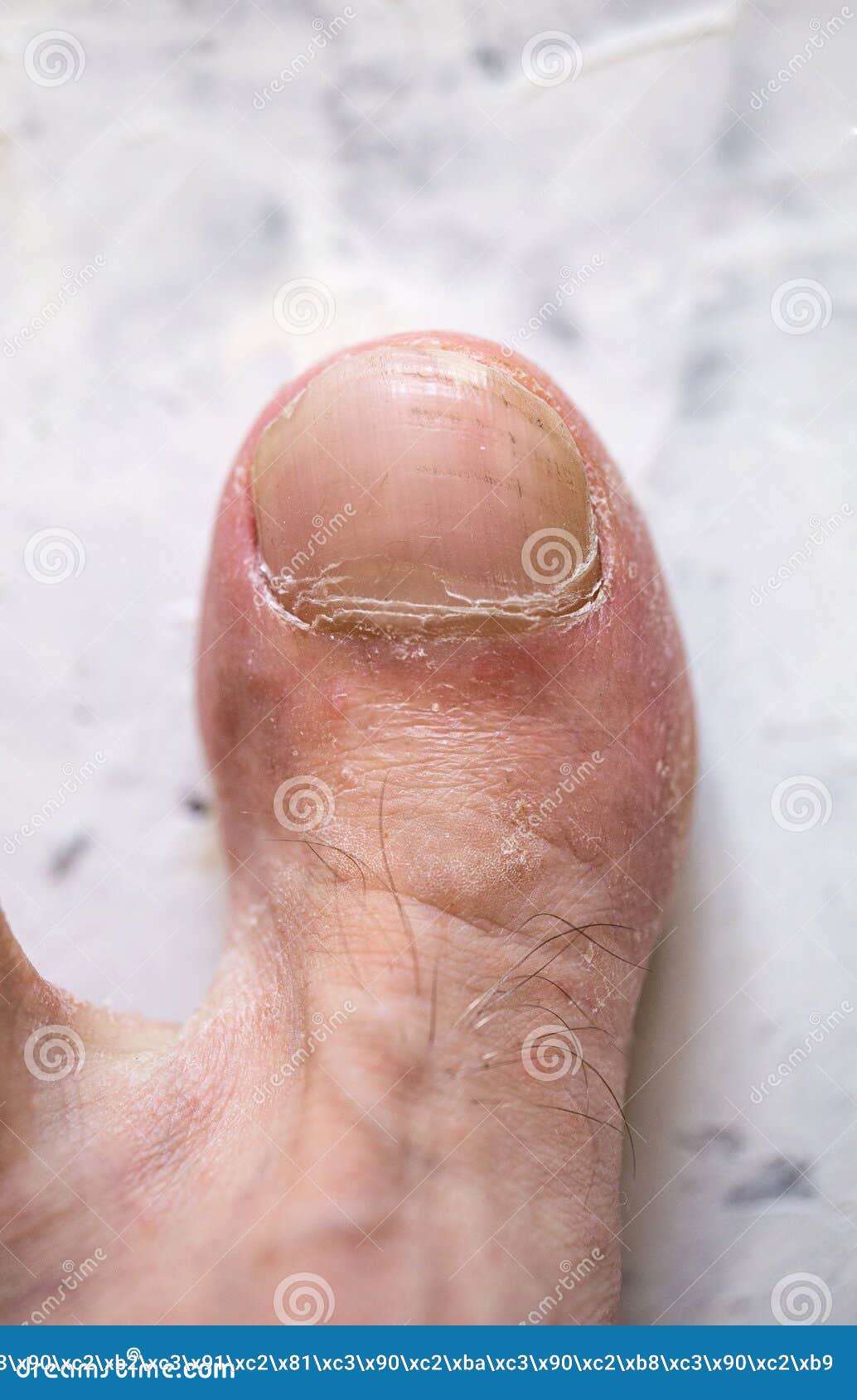 Big toe of a man close up stock photo. Image of person - 220953330
