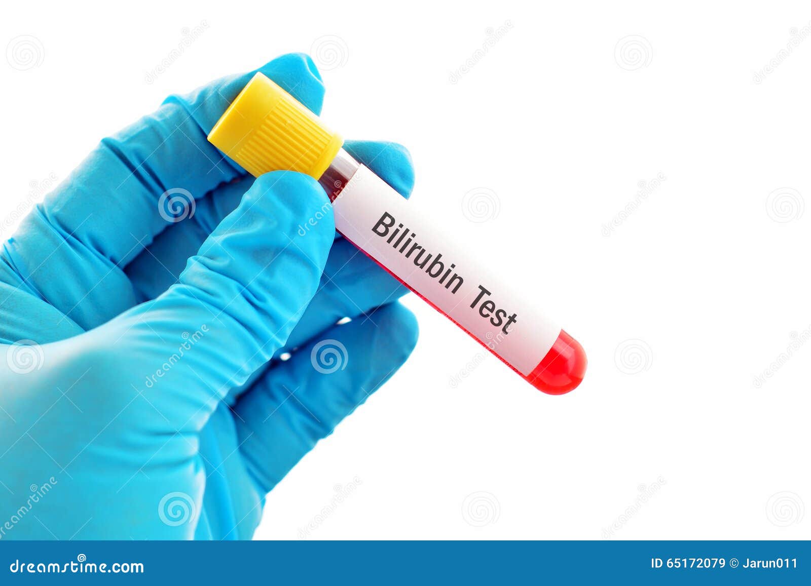 Bilirubin test stock image. Image of medicine, laboratory - 65172079