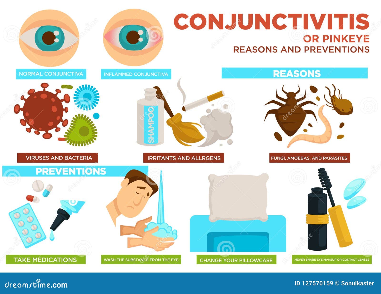 Bindvliesontsteking of Pinkeye Redenen En Preventiesaffichevector ...
