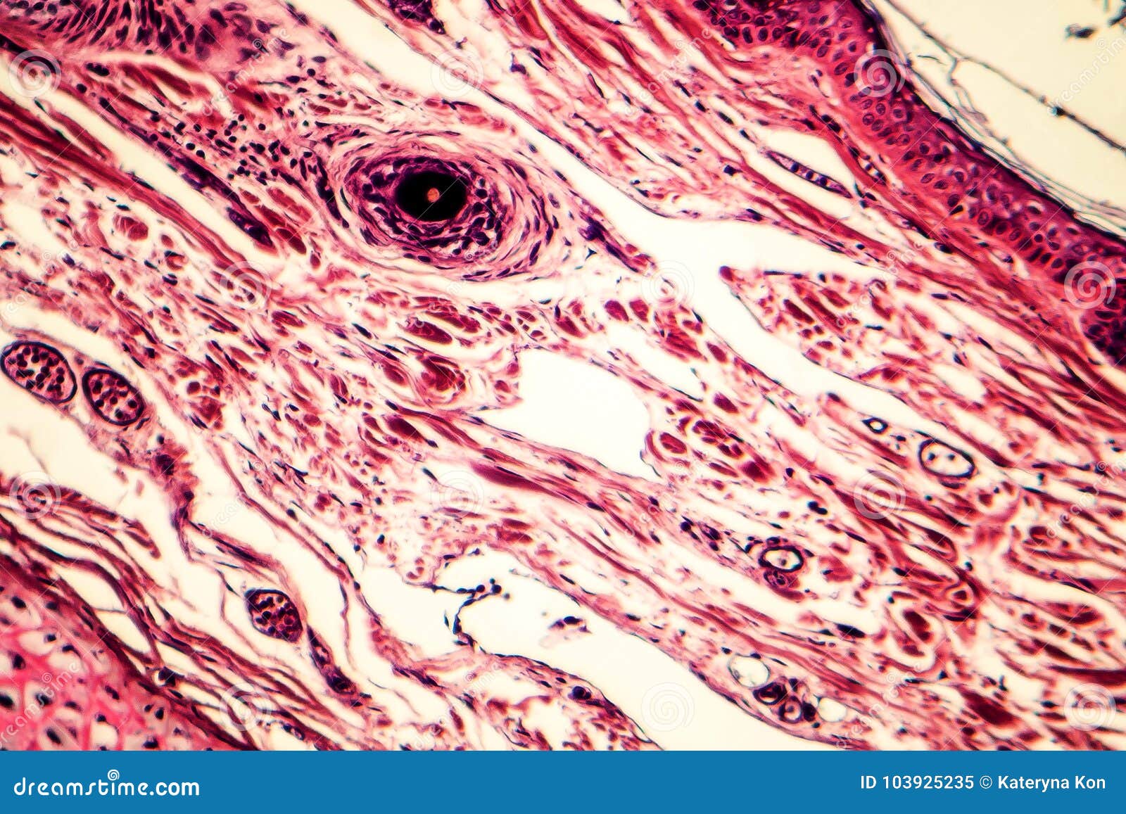 Bindweefsel, Lichte Micrograaf Stock Afbeelding - Image of micrograaf ...