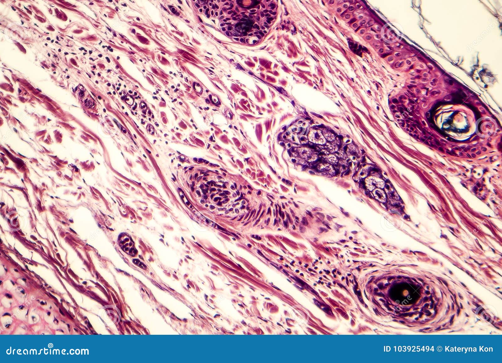 Bindweefsel, Lichte Micrograaf Stock Foto - Image of weefsel, microfoto ...