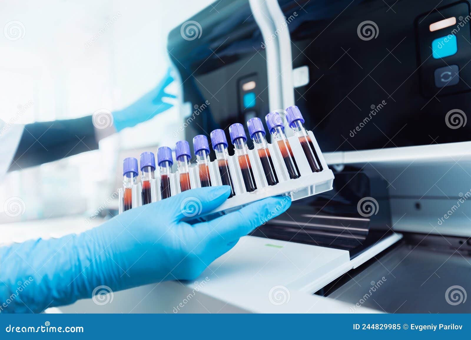 Biochemical Analyzer Blood Tests on Modern Equipment of Laboratories ...