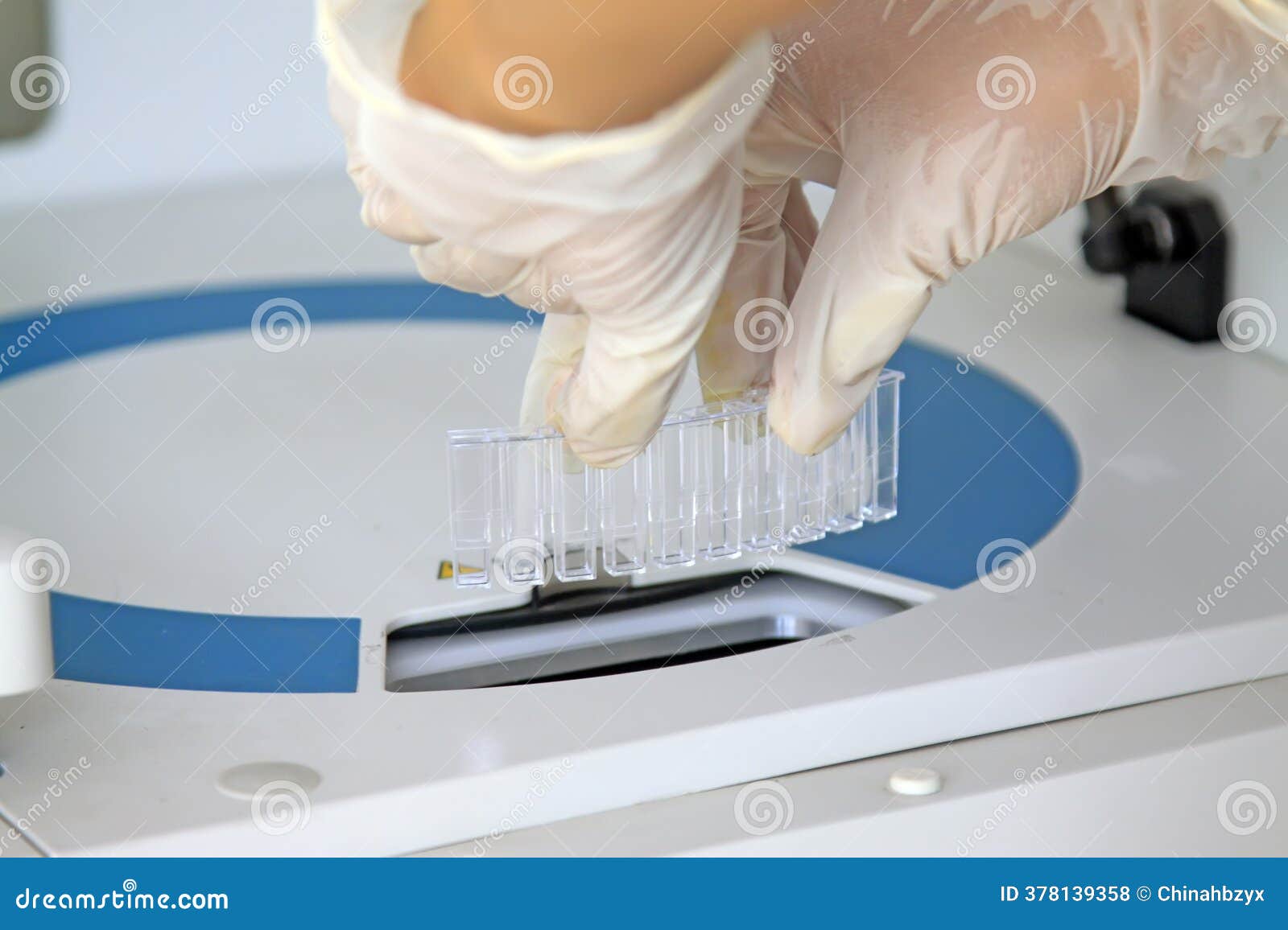 Biochemical Analyzer Test In Centers For Disease Control Stock ...