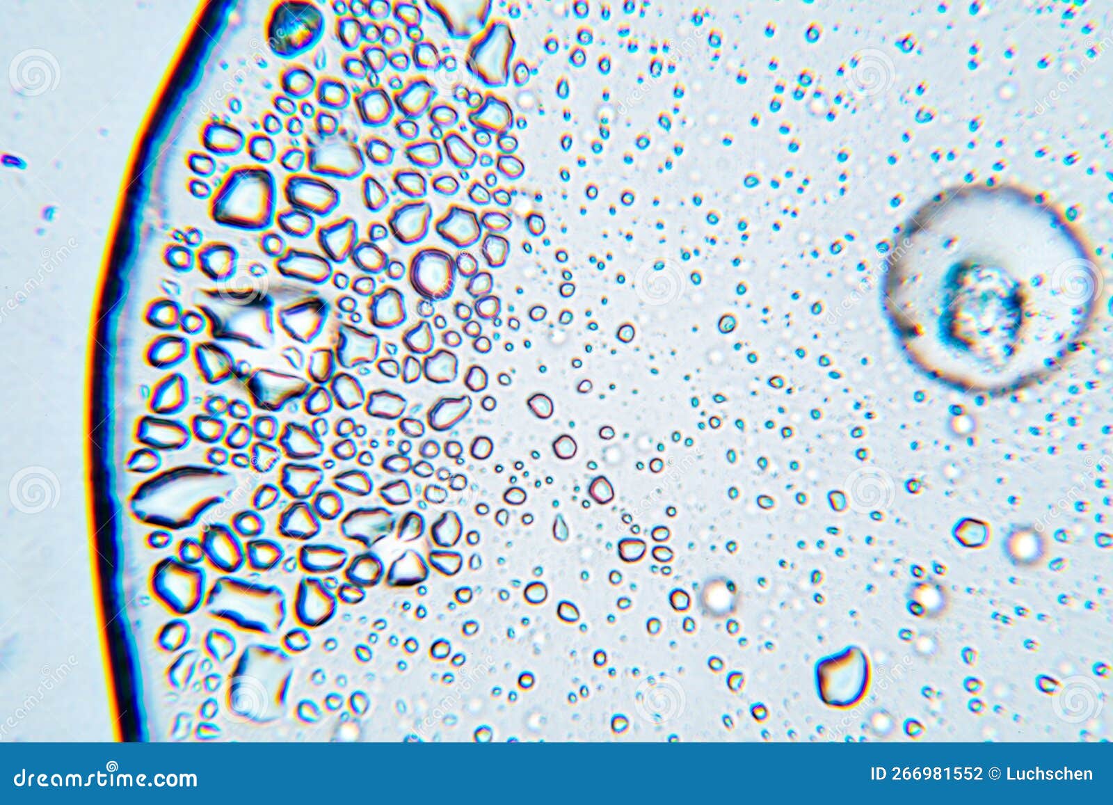 Biological Fluid at a Crime Scene Under a Microscope As Evidence of a ...