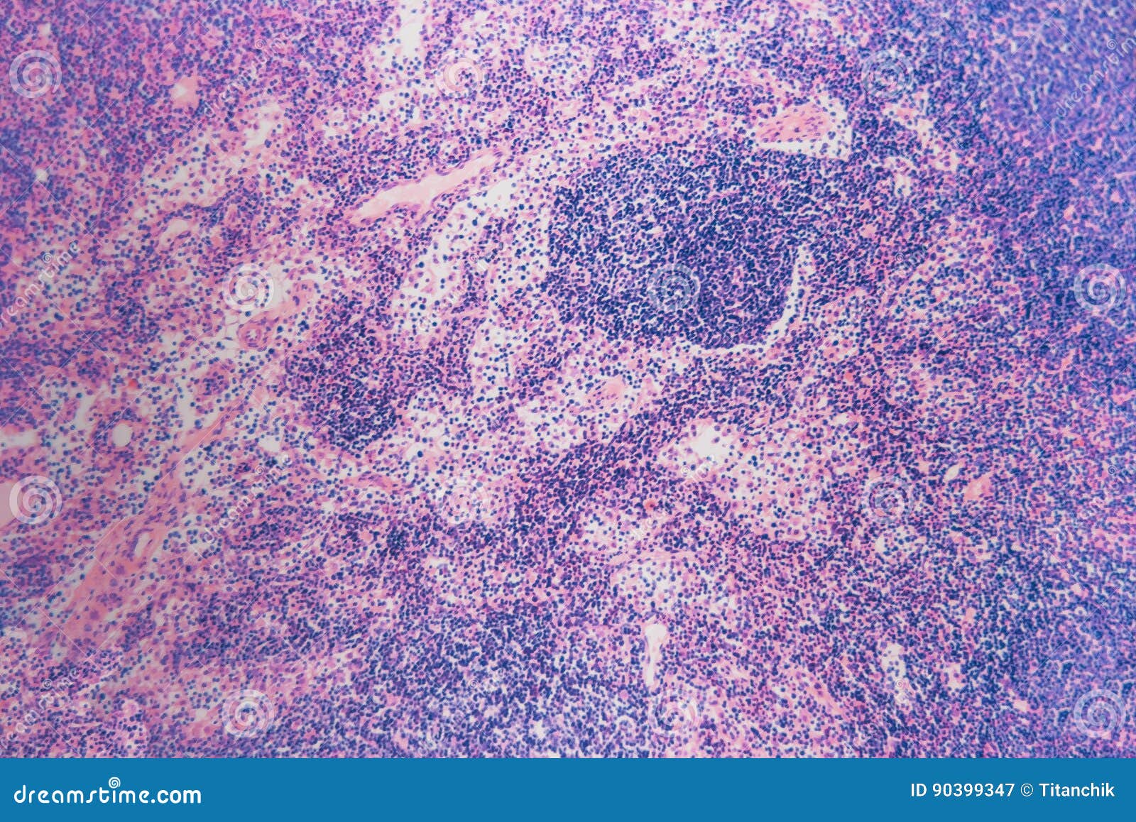 Lymph Node Microscope Slide