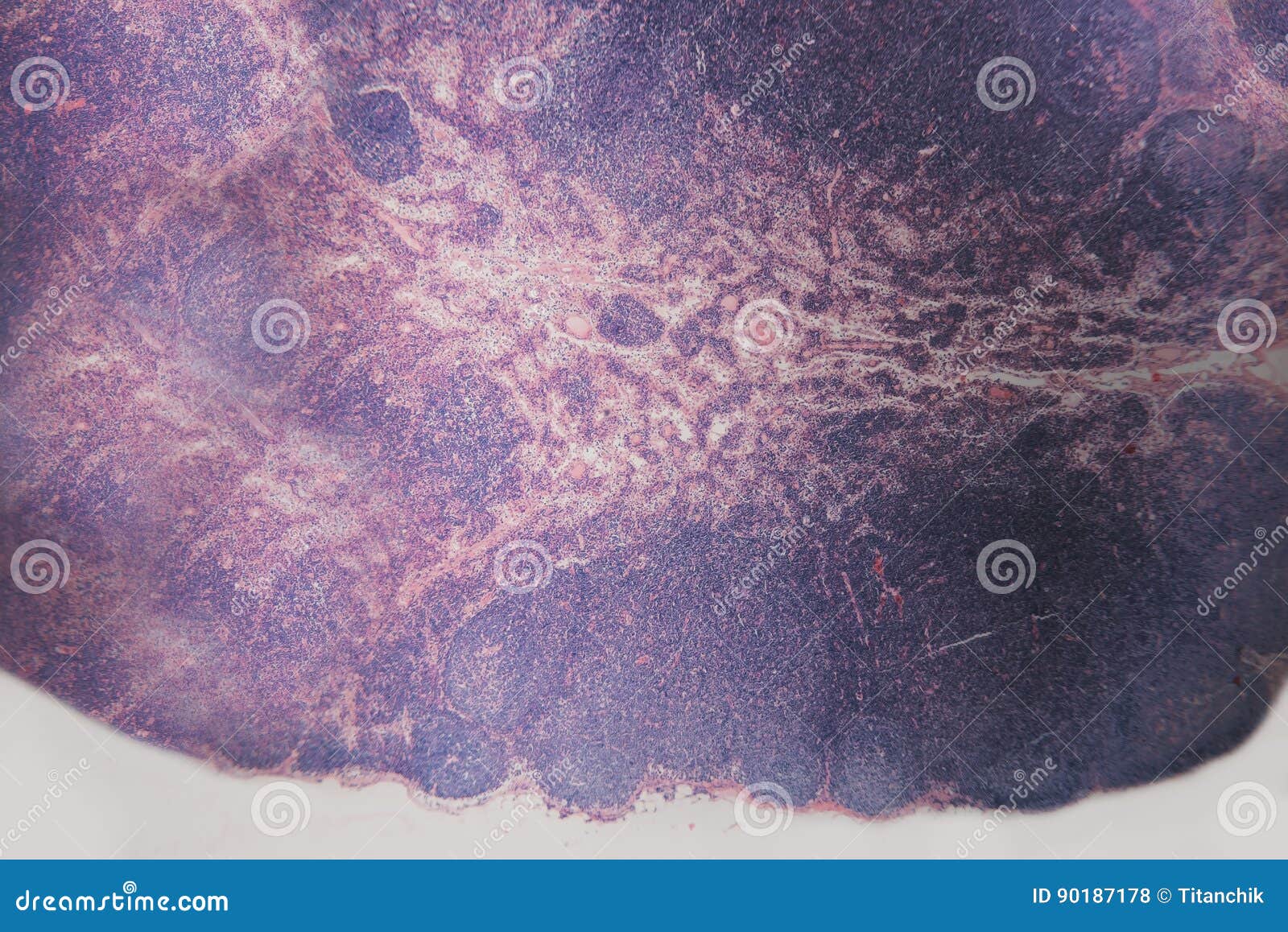 Lymph Node Microscope Slide