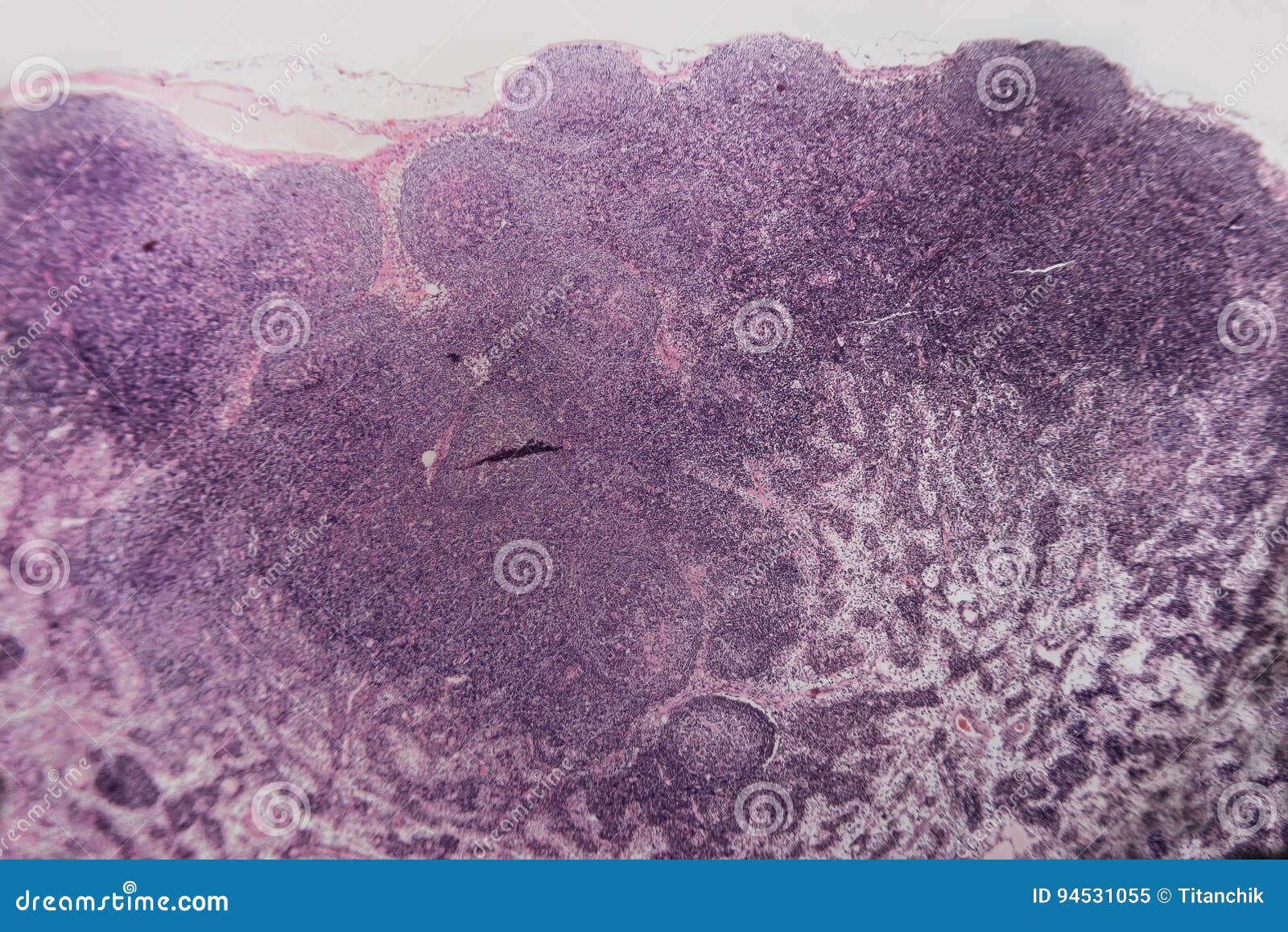 Lymph Node Cells Under The Microscope. Royalty-Free Stock Image ...