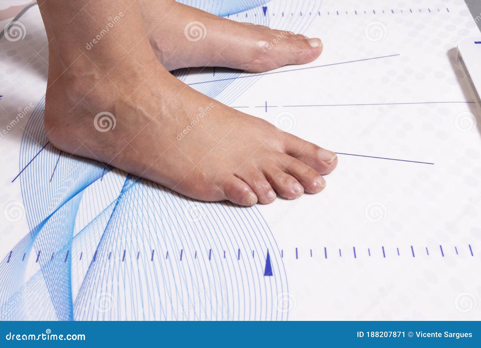 Biomechanical Study of the Tread Stock Image - Image of orthopedic ...
