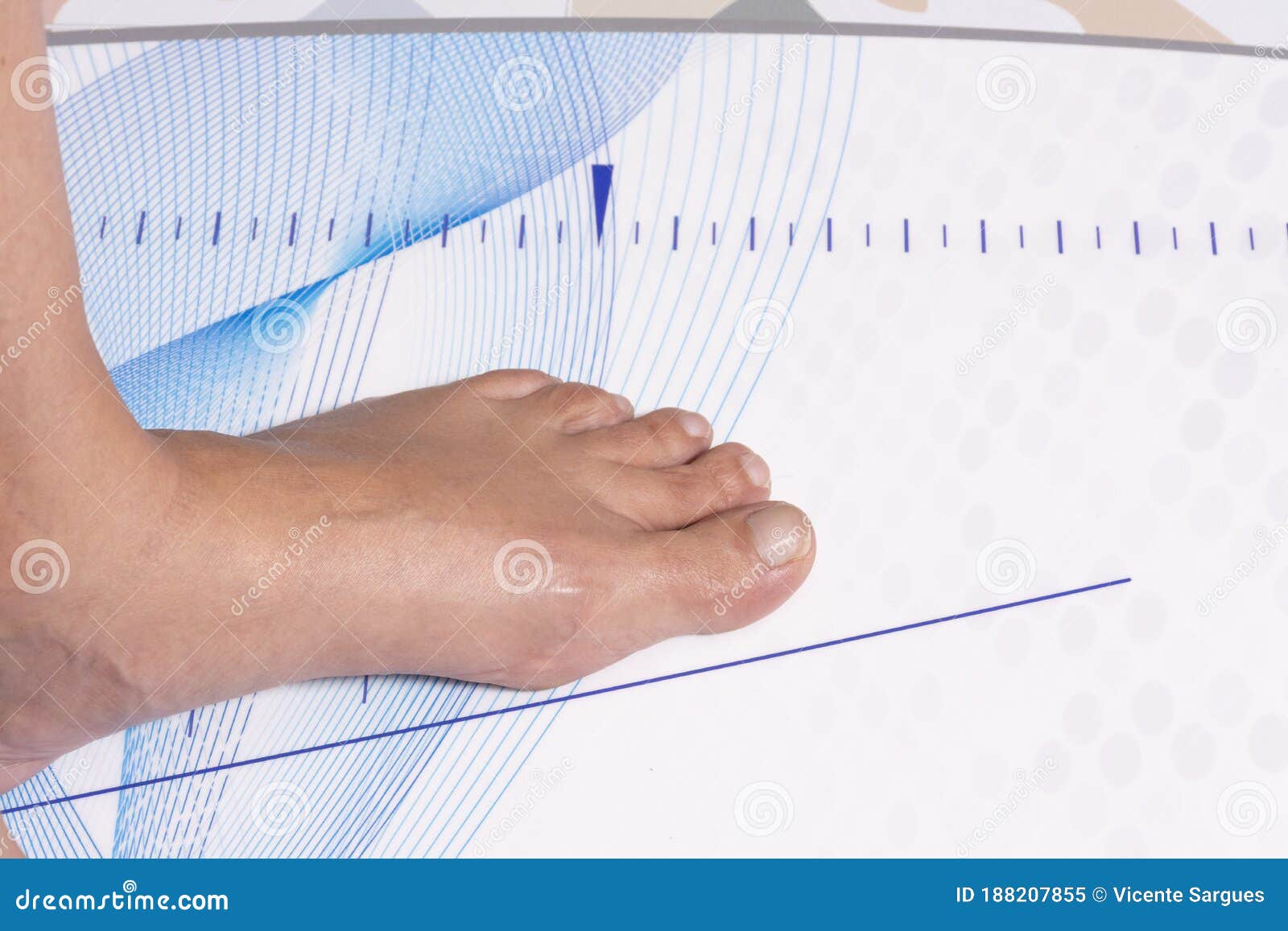 Biomechanical Study of the Tread Stock Image - Image of orthopedic ...