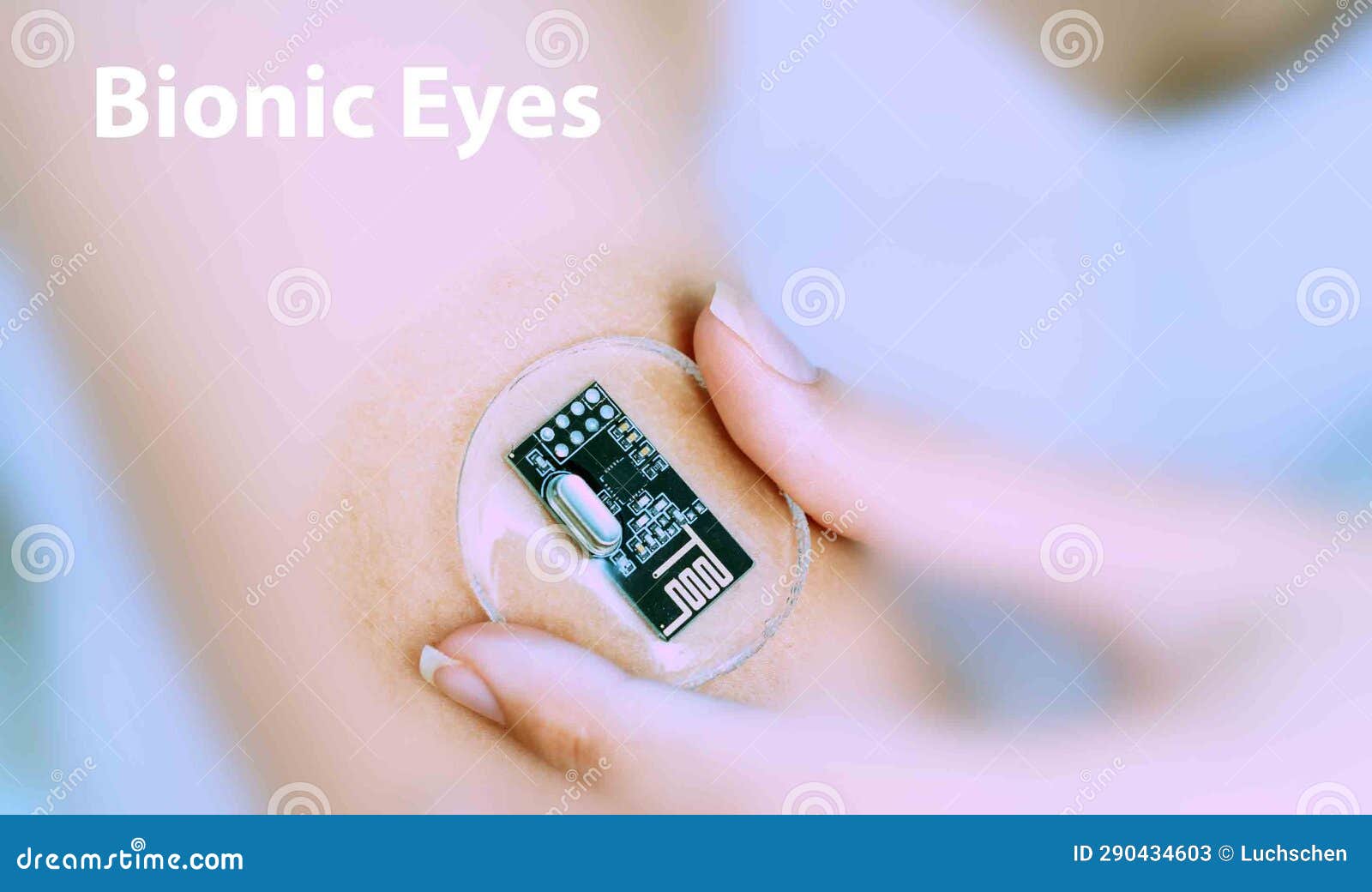 Bionic Eyes Implantable Electronic Medical Devices Concept Stock Image ...