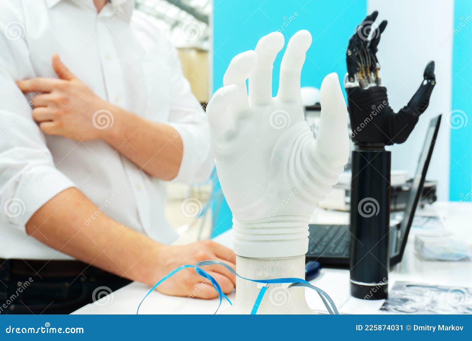 Bionic Hand. Demonstration of Modern Technology of Limb Prosthetics ...