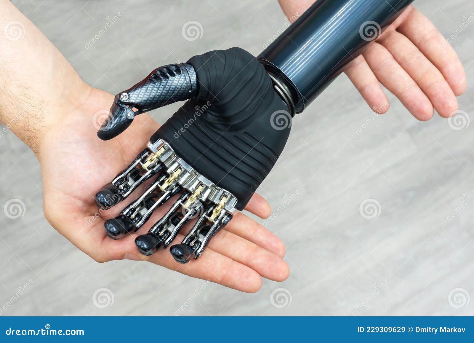 Bionic Hand. Modern Technology Prosthetic Limbs Stock Image - Image of ... Bionic Hand. Modern Technology Prosthetic Limbs Stock Image - Image of ...