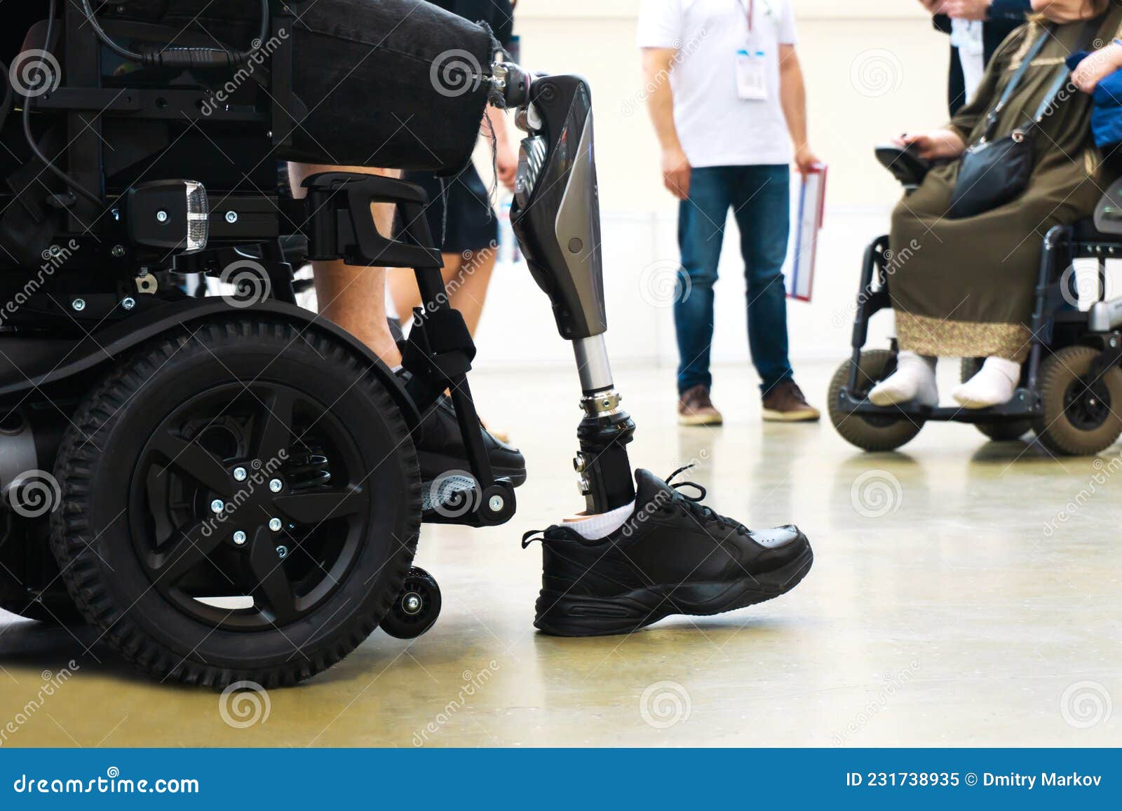 Bionic Prosthetic Leg. Modern Technology For Prosthetic Limbs Royalty ...