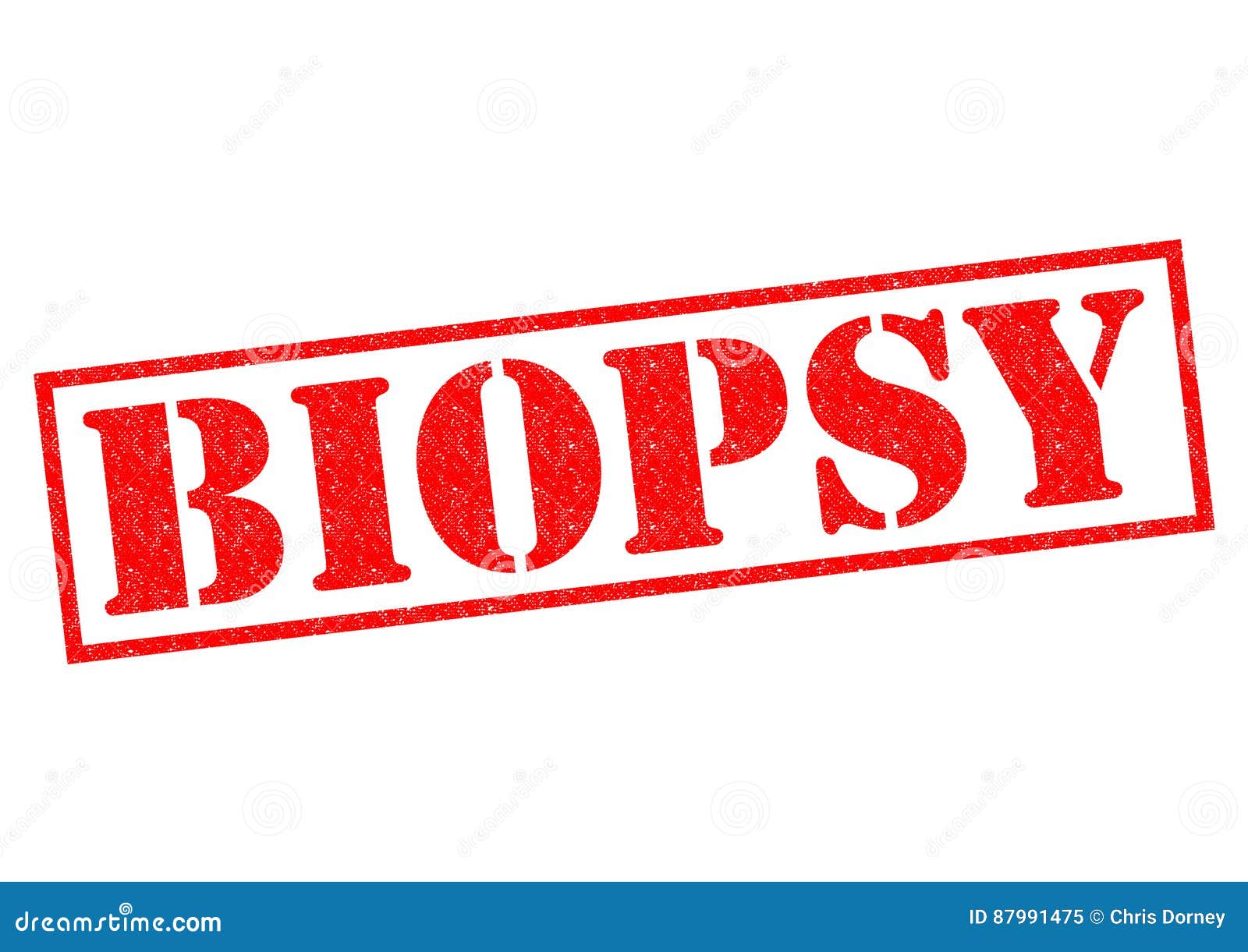 BIOPSY Rubber Stamp stock image. Image of medicine, icon - 87991475