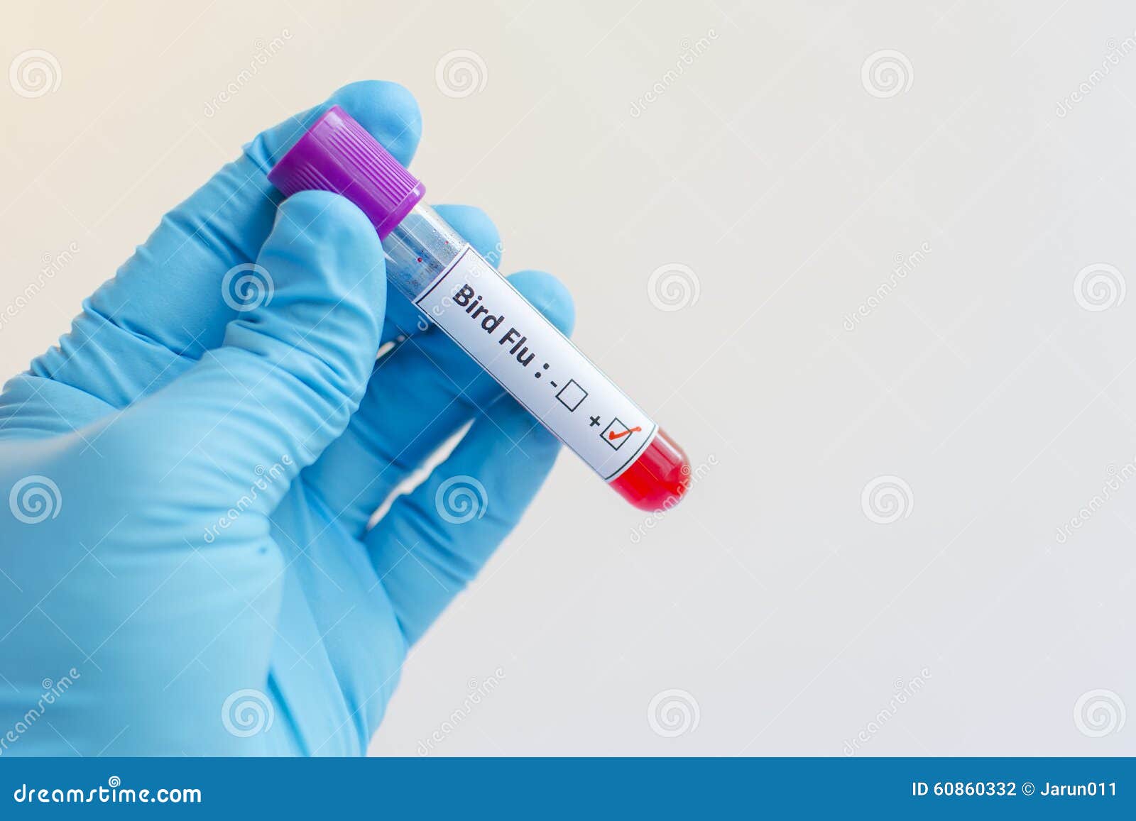 Bird Flu blood sample stock photo. Image of micro, biology - 60860332