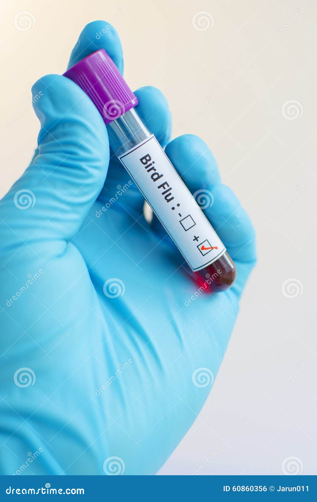 Bird Flu blood sample stock photo. Image of h1n1, common - 60860356