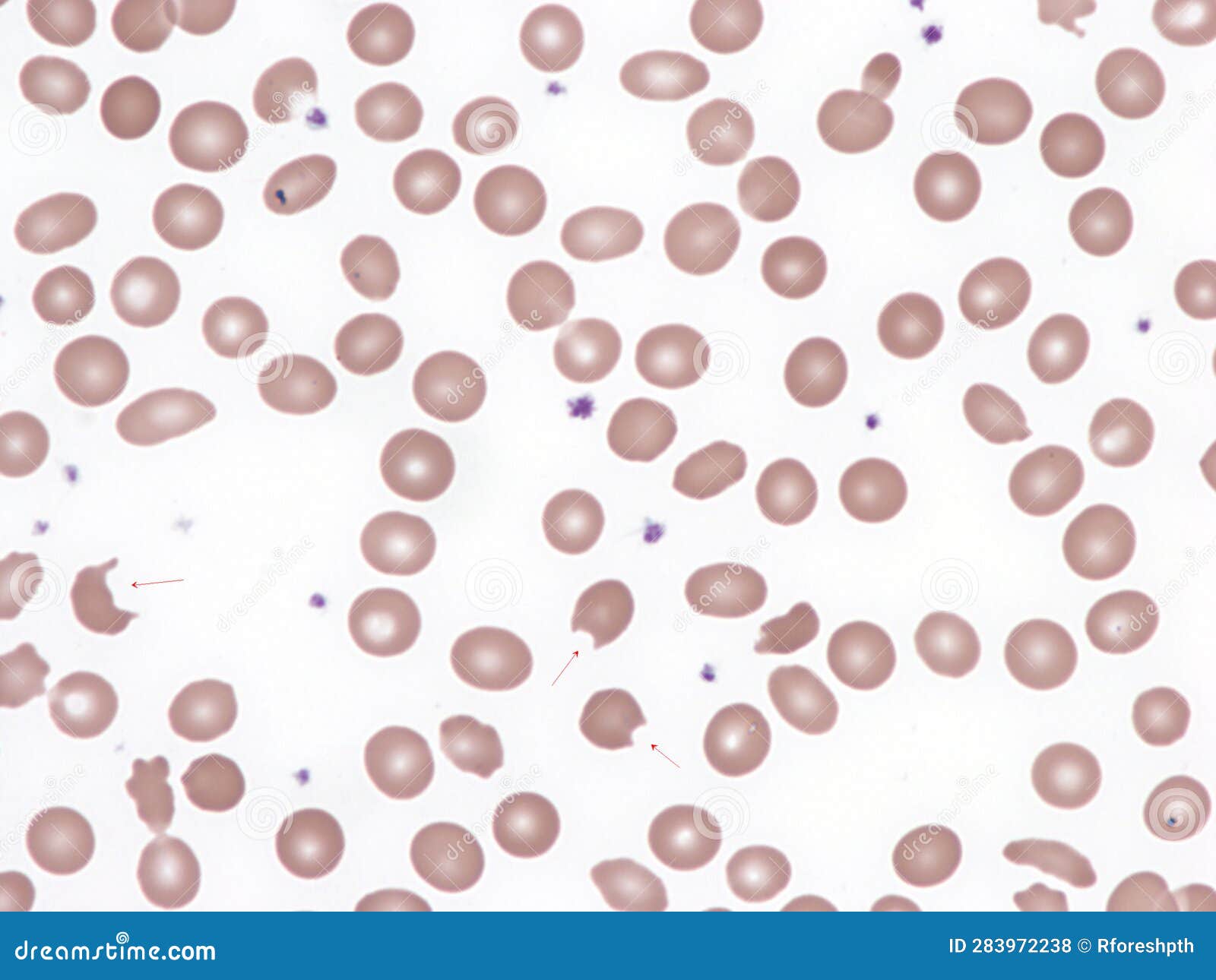 Bite Cells. Stock Photography | CartoonDealer.com #283972238