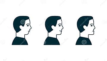 Bite Normal Jaw and Malocclusion, Face Man in Profile Set. Dental ...