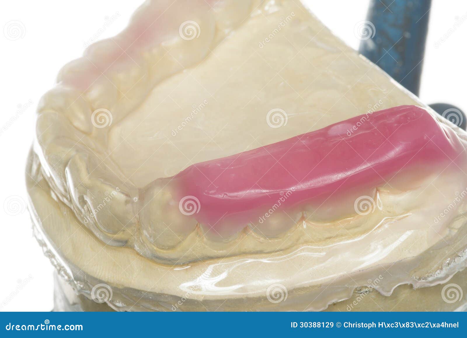 Bite splint stock image. Image of laboratory, teeht, splint - 30388129