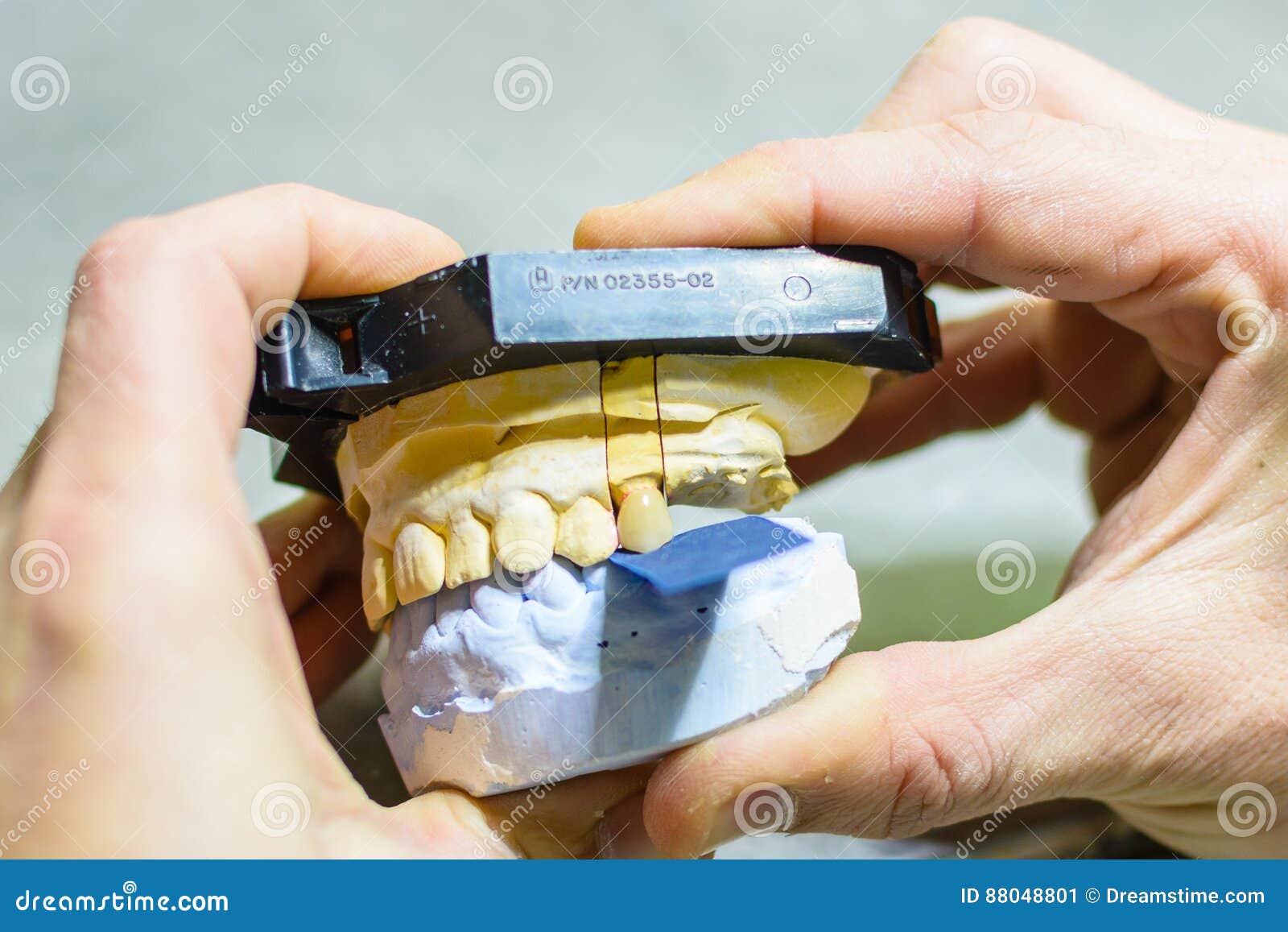 Biting Test with Prosthesis Molds Stock Image - Image of closeup, mouth ...
